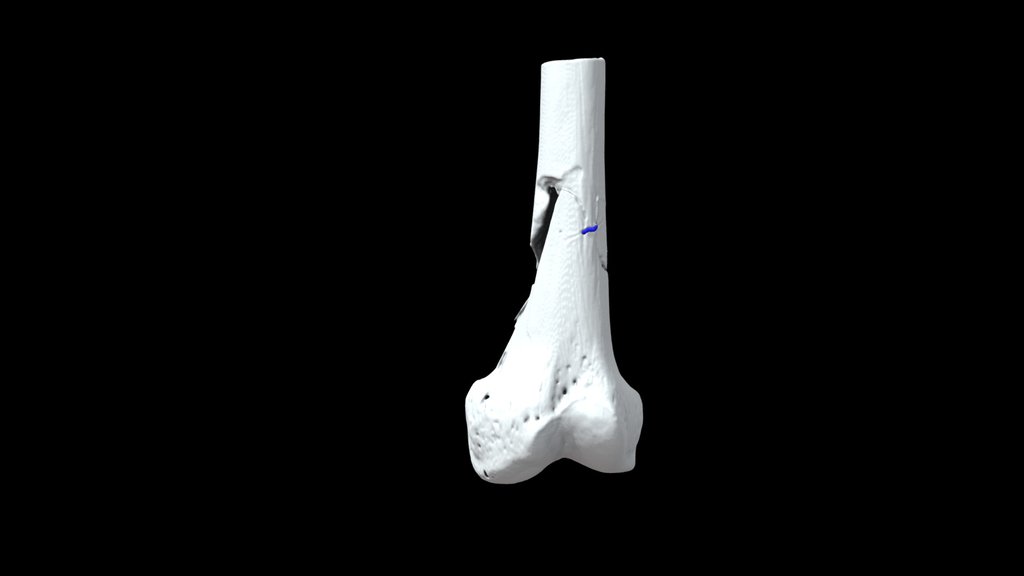 My CT Models - A 3D model collection by Terrie Simmons-Ehrhardt ...