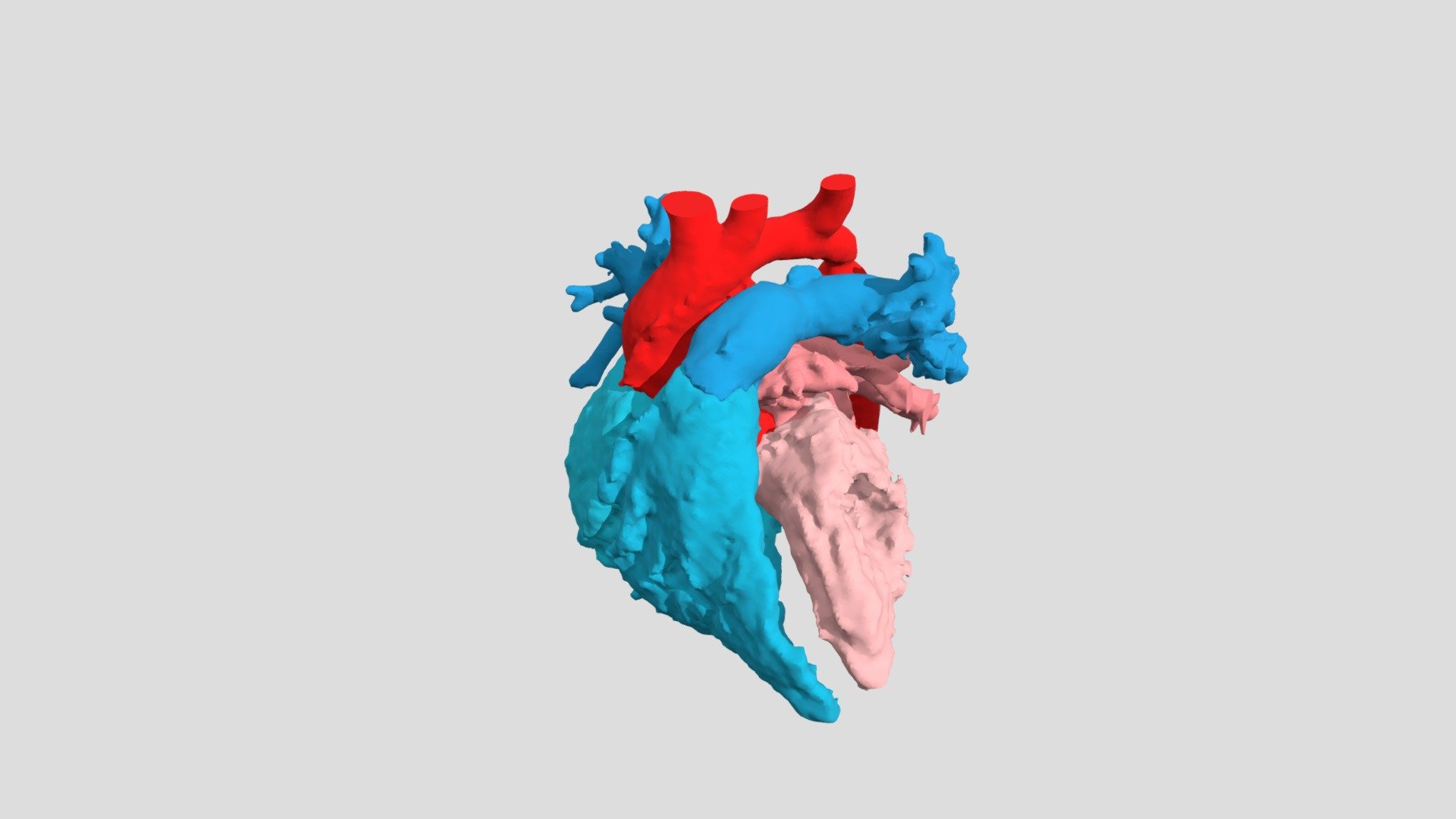 Aortic Coarctation (S0256) - 3D model by NCHS Cardiac Advanced Projects ...
