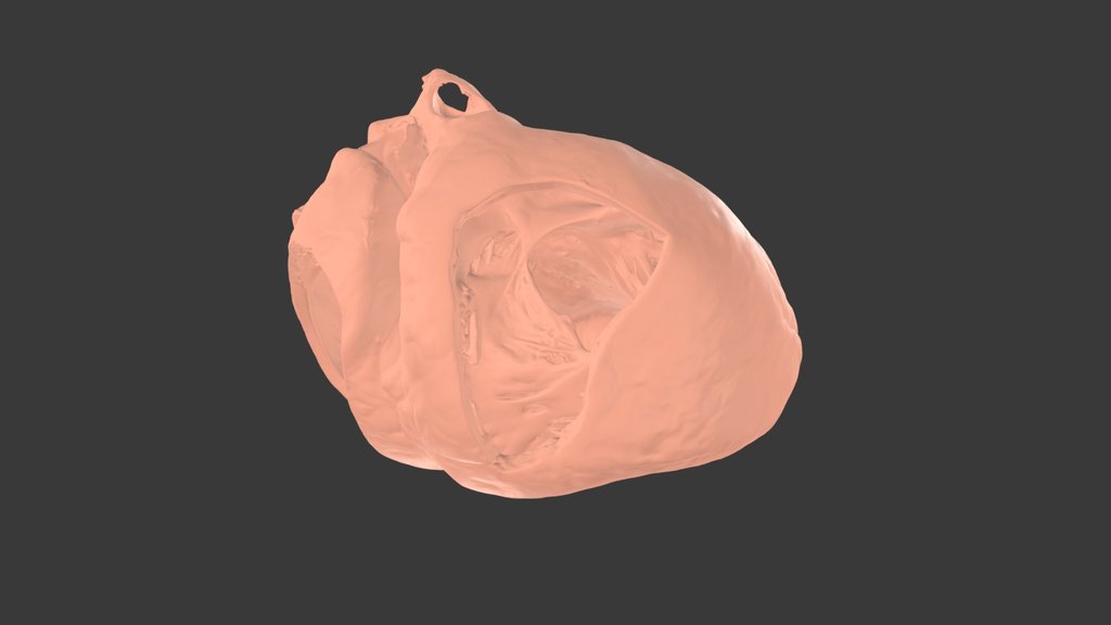 Ebstein - A 3D model collection by heartmodels - Sketchfab