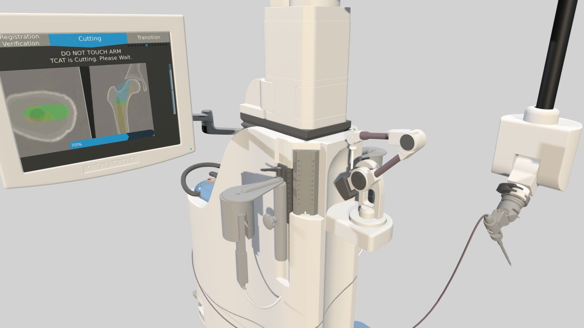 TCAT - 3D model by THINK Surgical (@gyou) [4df63ce] - Sketchfab