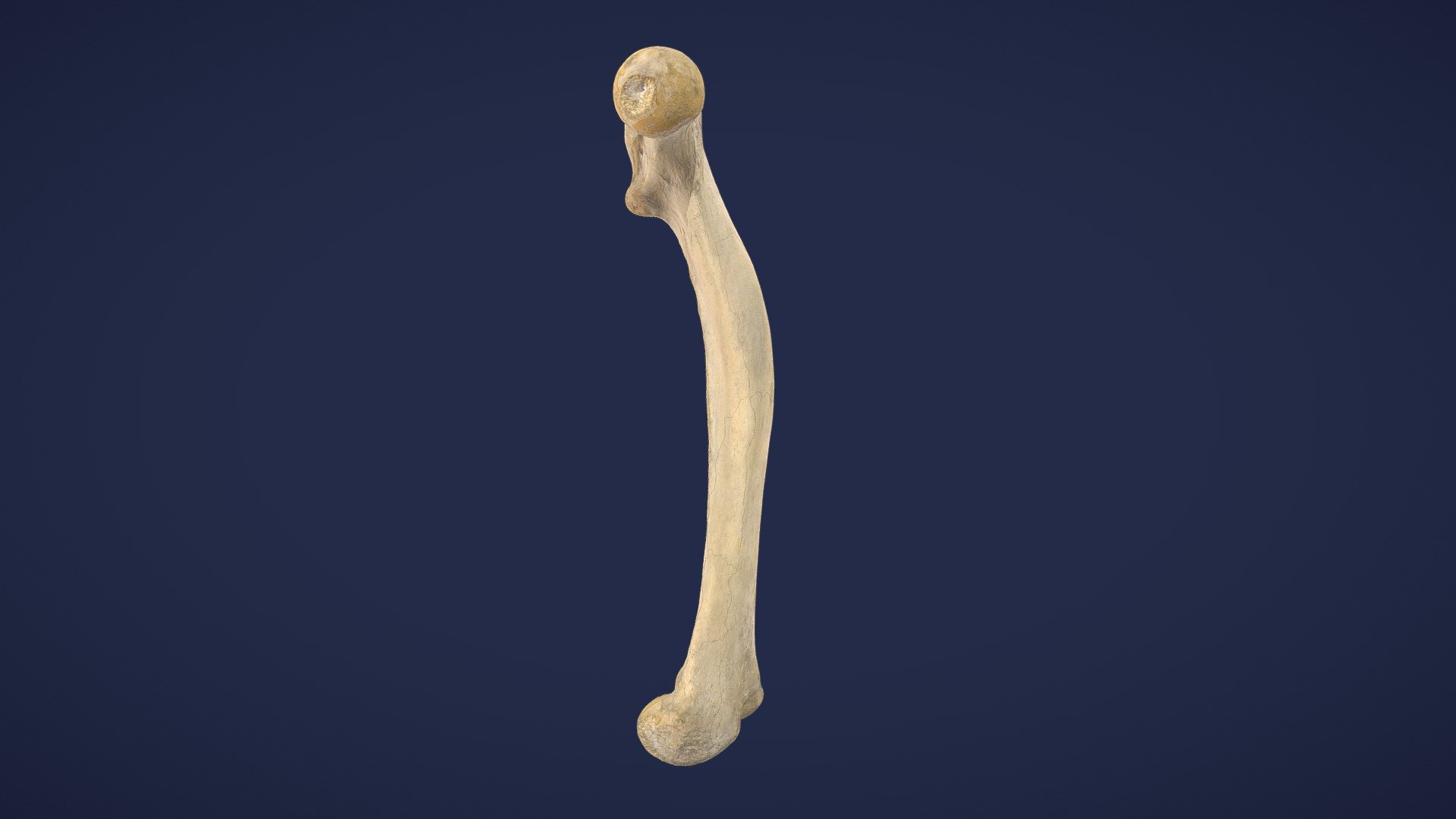 Femur links (Rachitis) - 3D model by Institute of Anatomy Rostock ...