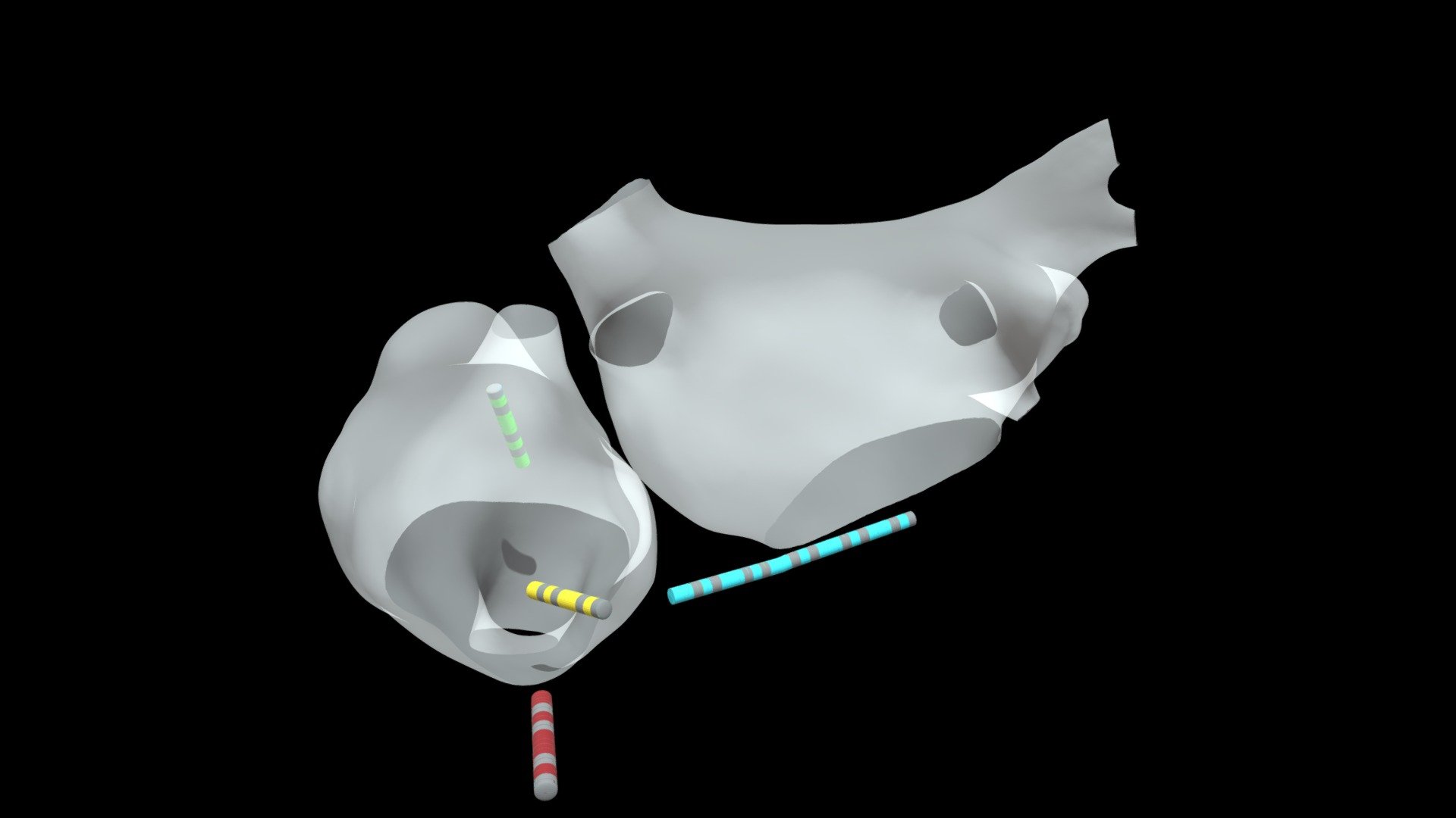 Catheter Locations - annotated - 3D model by drj (@drjameswinter ...