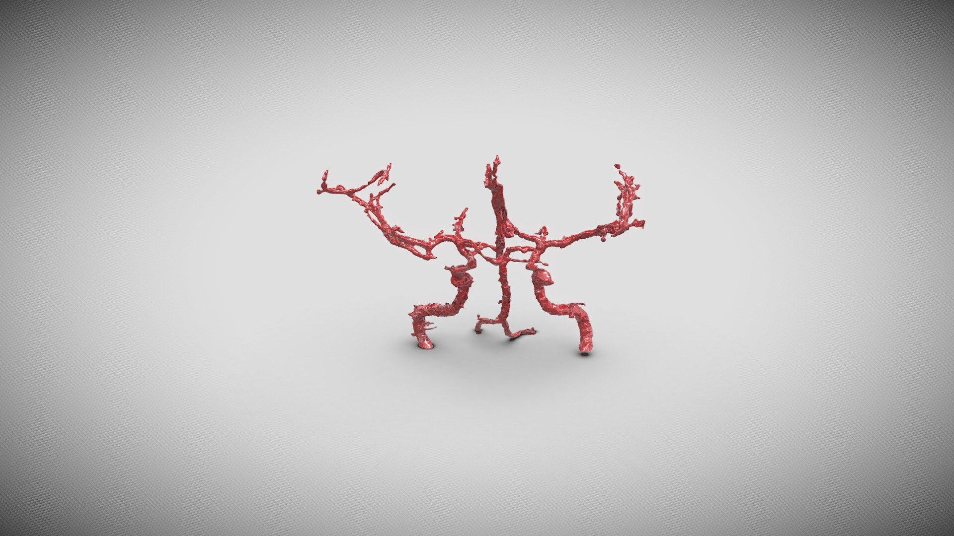 ES - Anterior Comm Aneurysm - 3D model by Dr. Samuel Damin (@sdamin ...