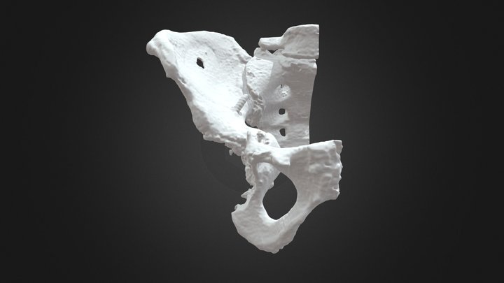 Hemipelvis 3D models - Sketchfab