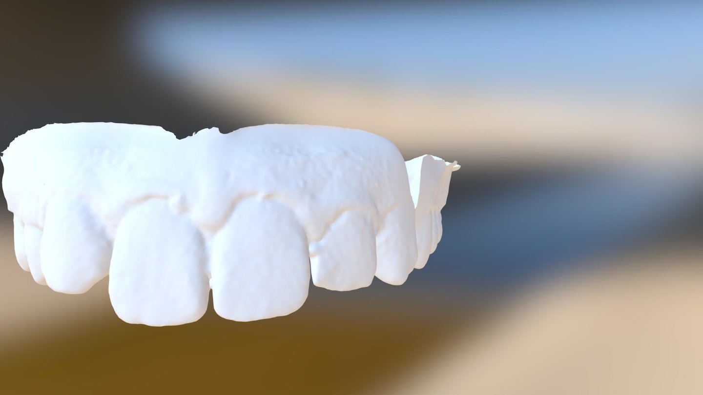 Maxillary Anatomy - 3D model by kamsiah [4f7d208] - Sketchfab