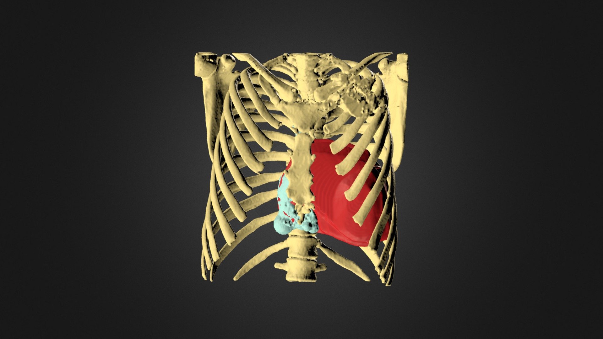 pectus multicomponent - 3D model by shinister [507b030] - Sketchfab