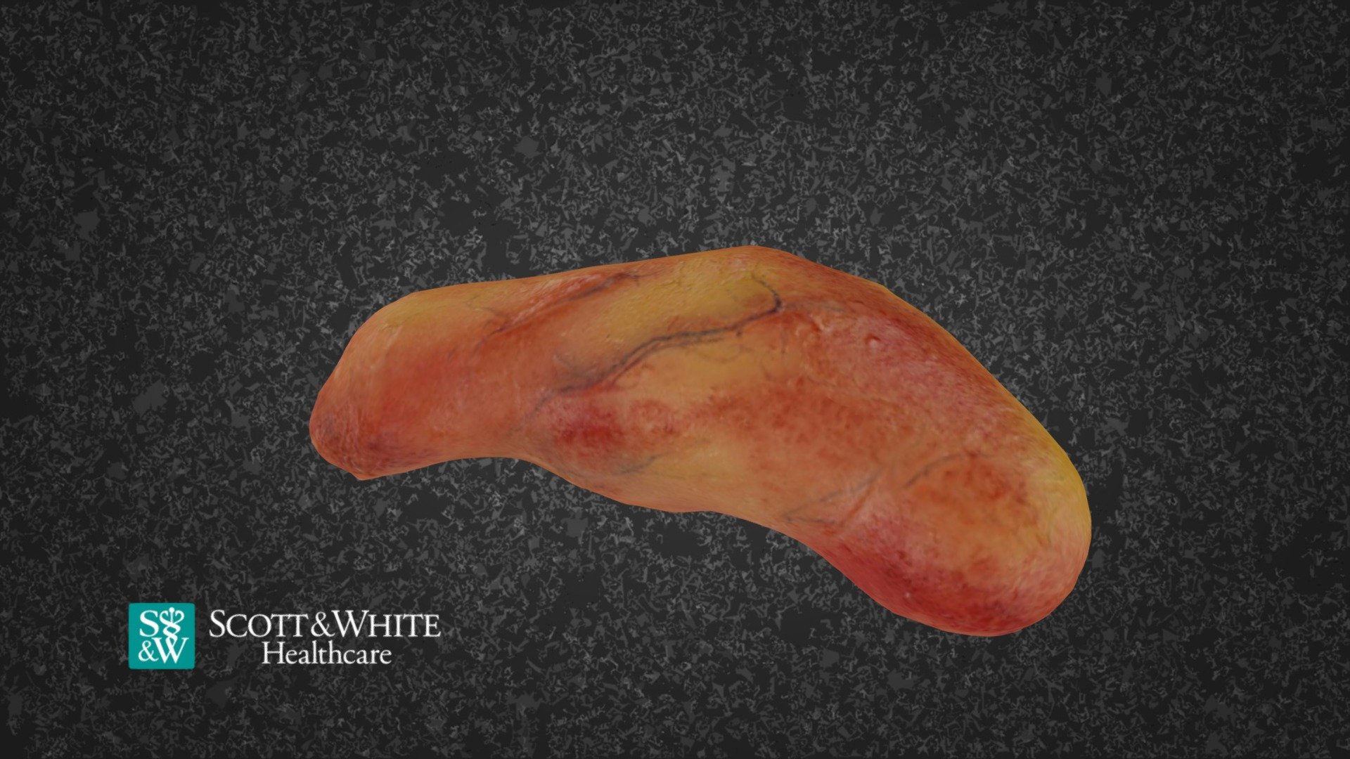 Gallbladder Intact 96924 - 3D model by Scott & White Moulage Project ...