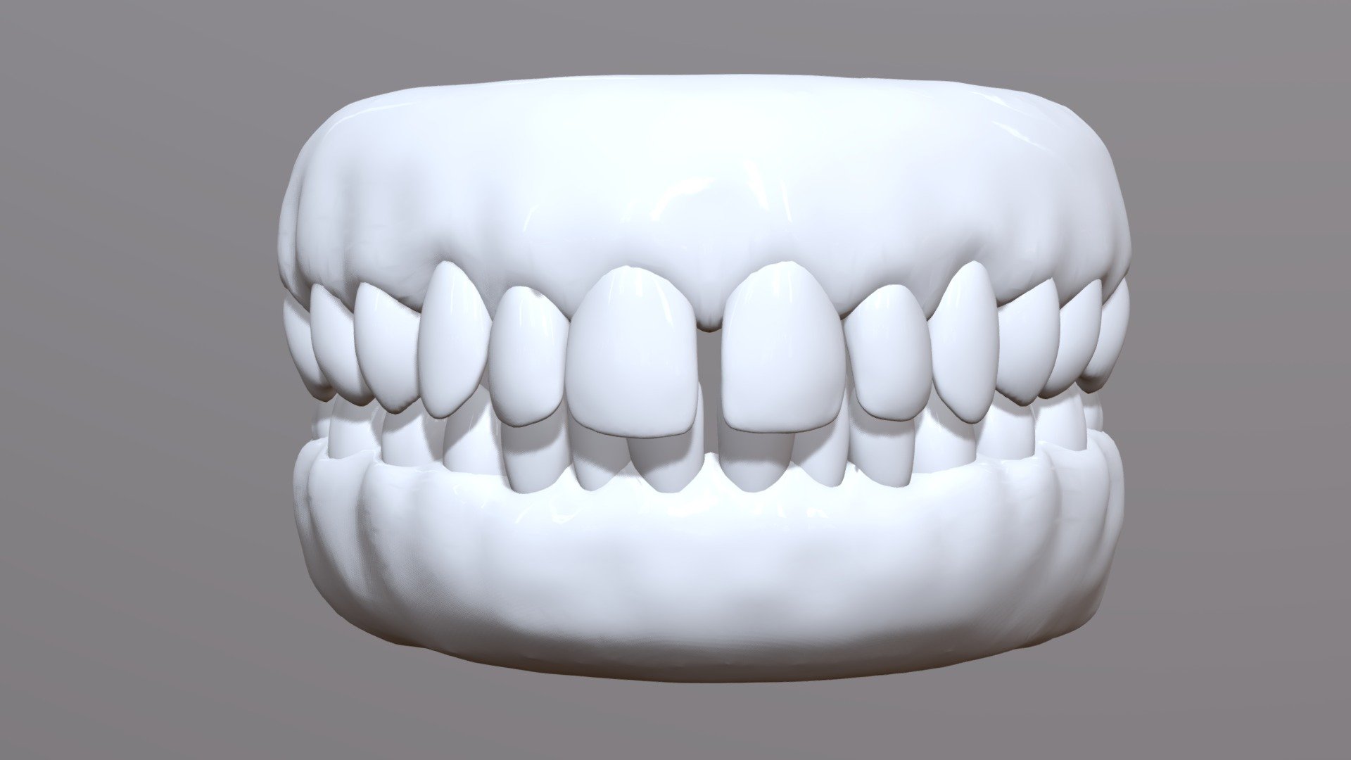 Teeth Movement 2 0 Spacing 1 Animation 3 - 3D model by dancoveycreative ...