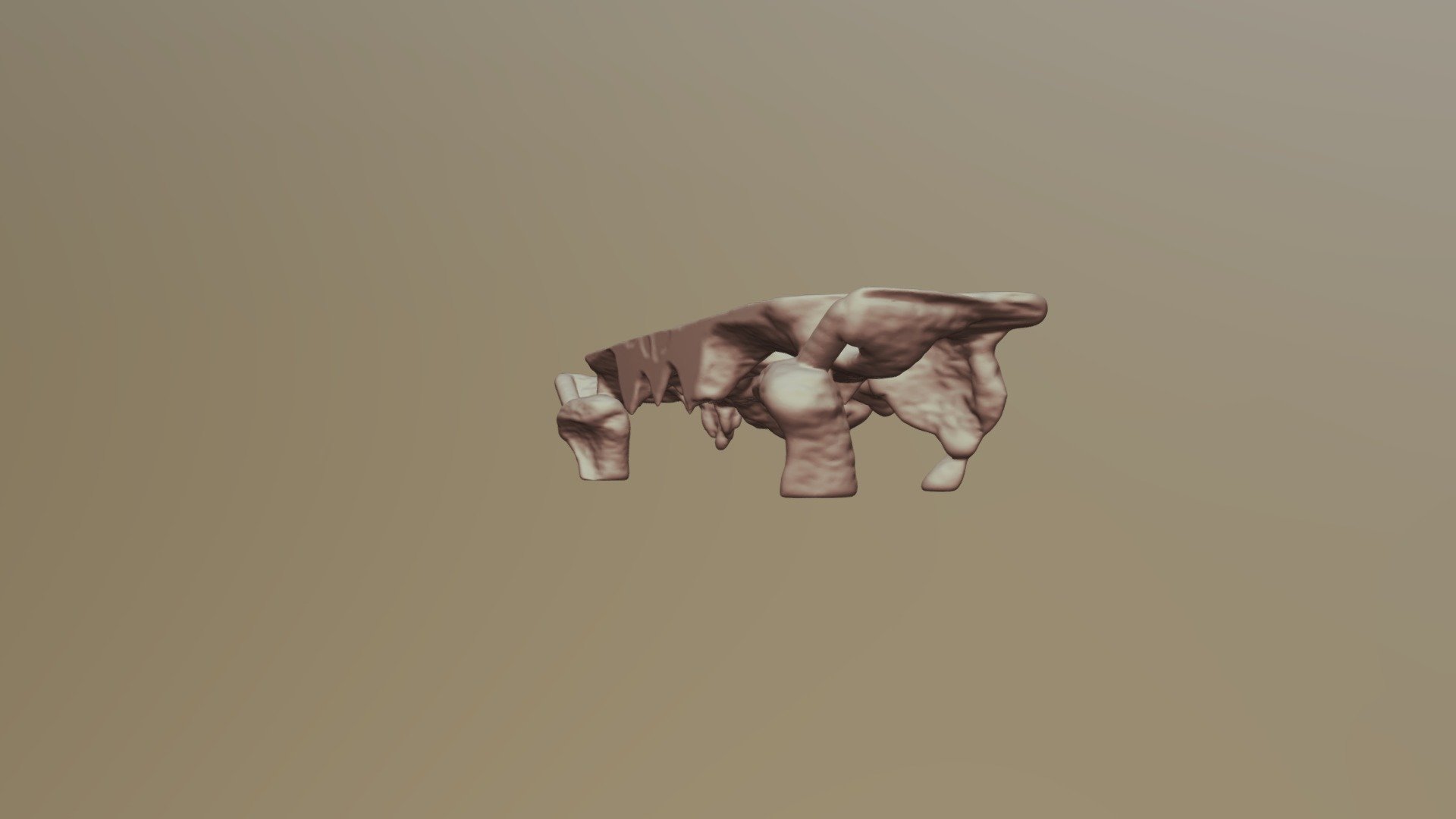 Anatomic TMJ ATM Joint - 3D model by 3Dsurgery [510e1f2] - Sketchfab