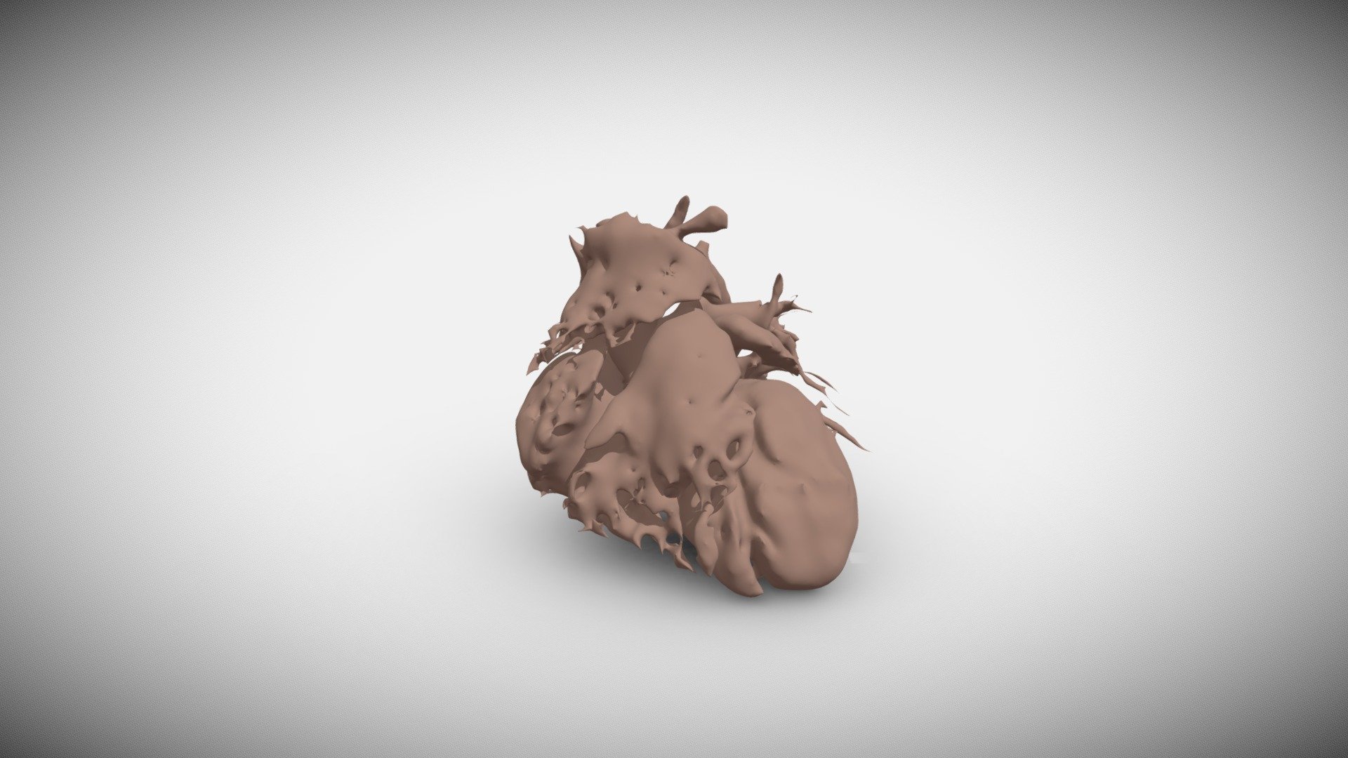 VSD - 3D model by Imre J. Barabás, MD, M.Sc. (@Uzzias18) [516ec8d ...