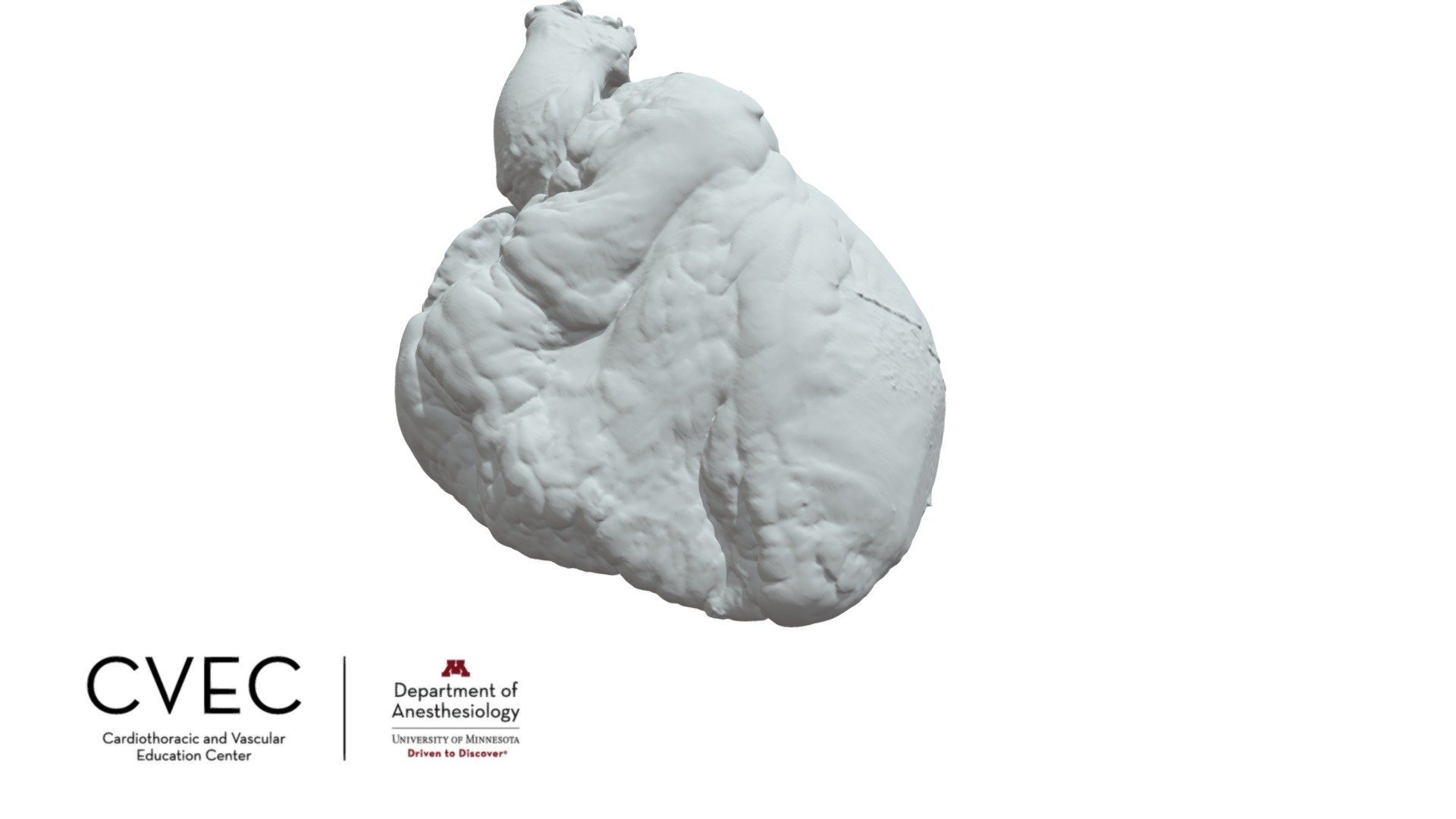 Heart with PFO - 3D model by CVEC [521ccf5] - Sketchfab