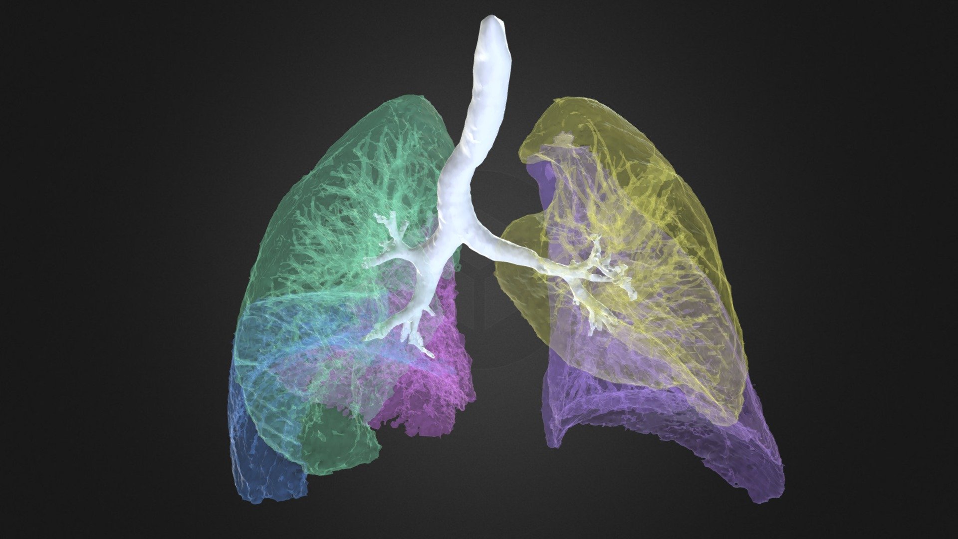 Lingular Torsion - 3D model by yuhuihuang [522b894] - Sketchfab