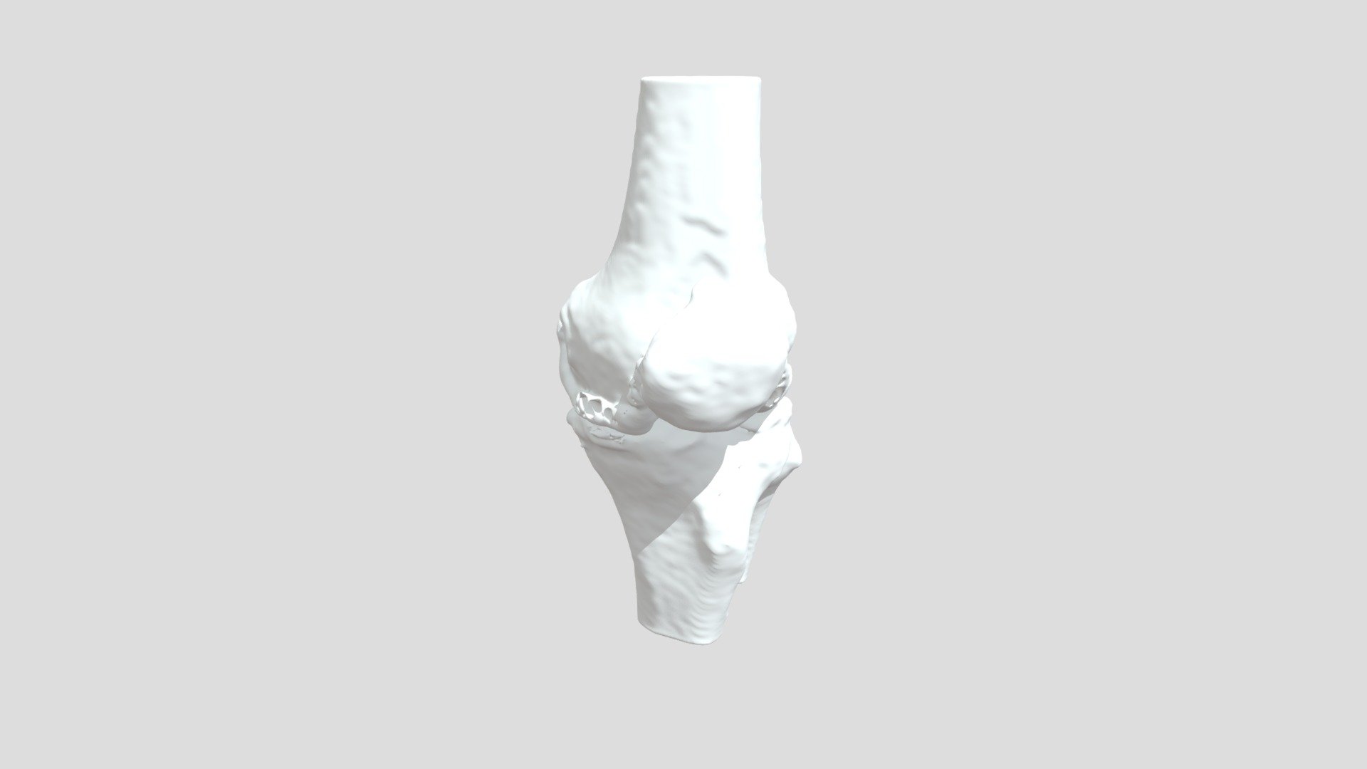 Segmentation Tr Tr Lt Bone - 3D model by curisdata.science [52349d4 ...