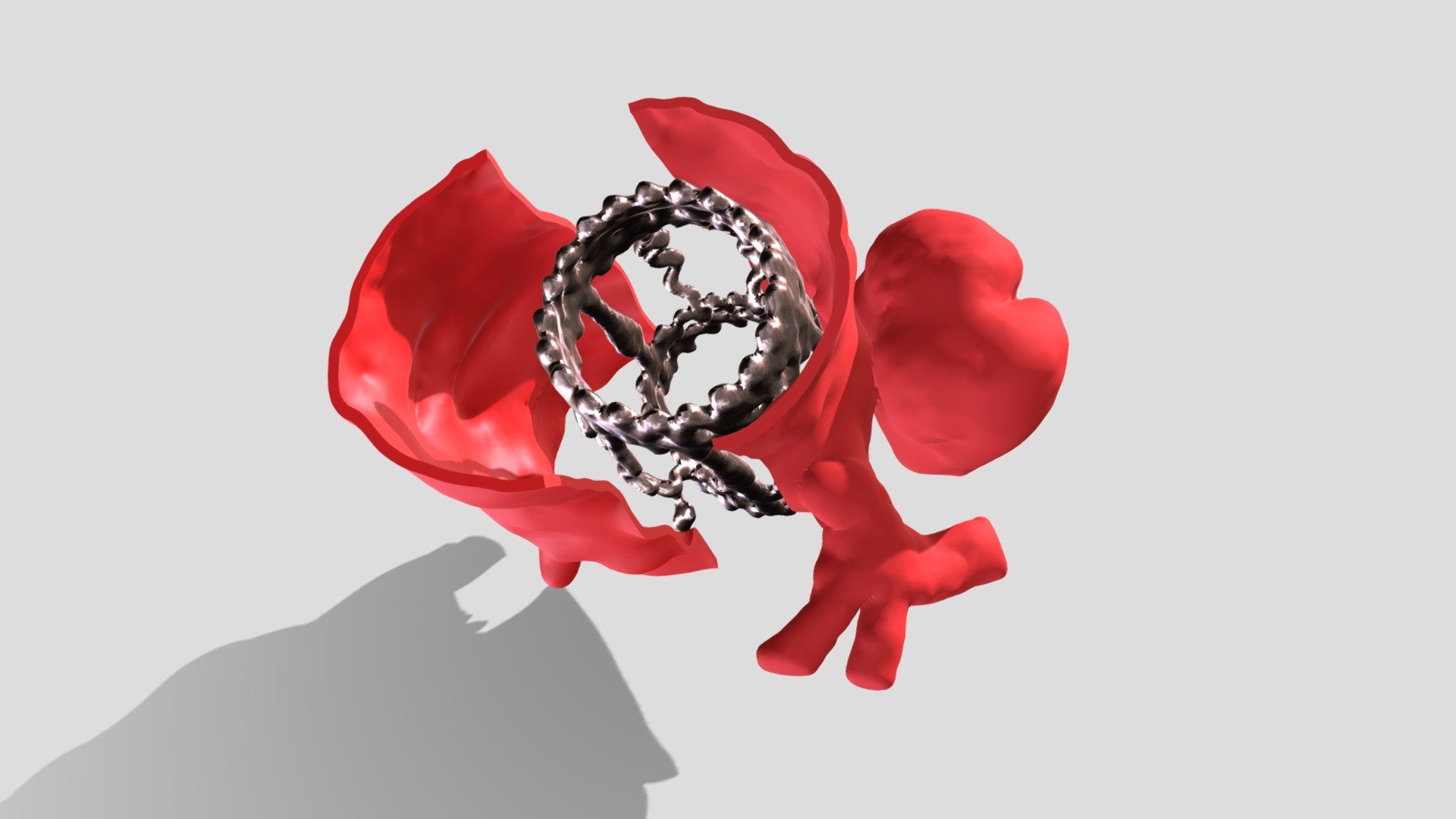Aortic root pseudoaneurysm - 3D model by Abdel Hakim Moustafa ...