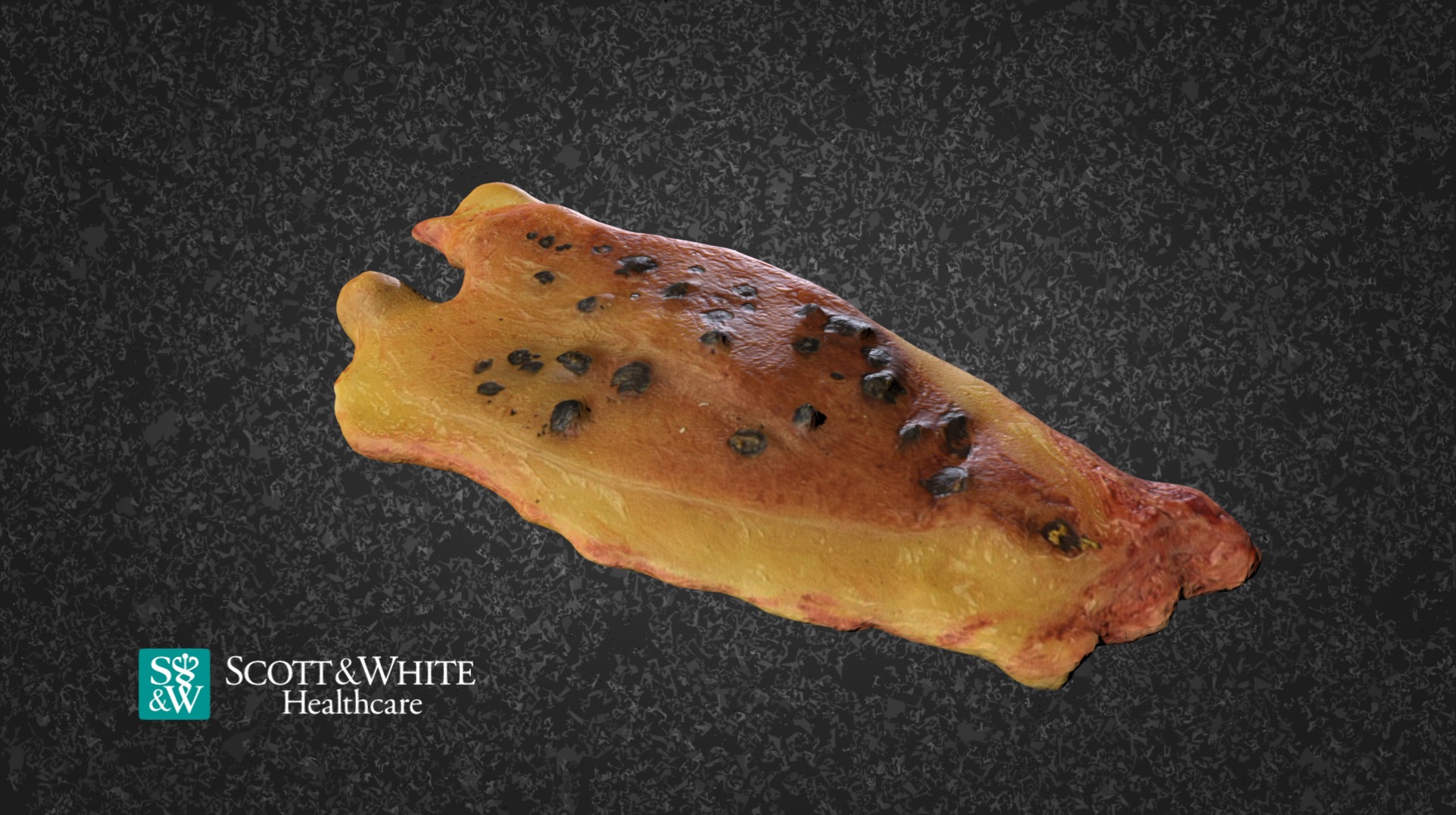 Gallbladder 90523 - 3D model by Scott & White Moulage Project ...