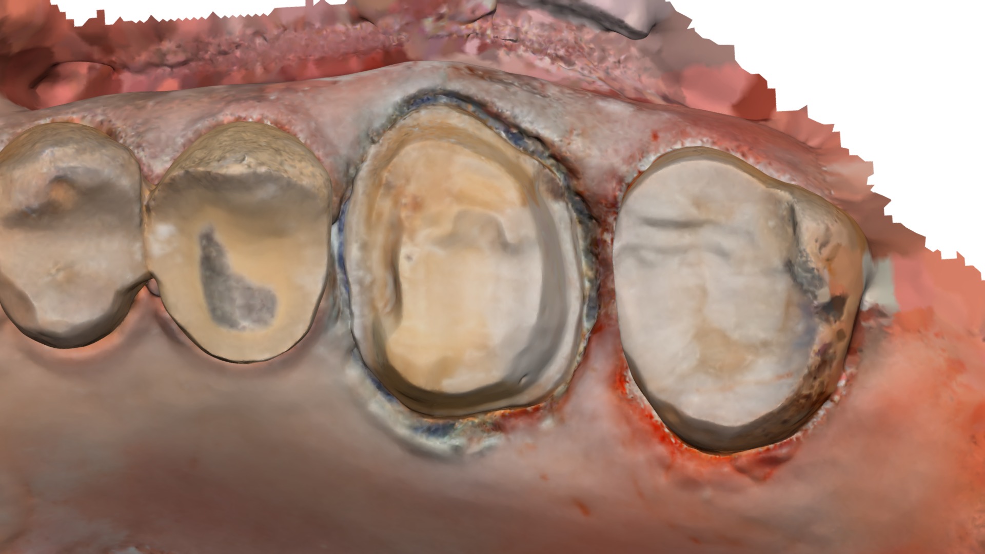 Maxillary - 3D model by bunbun22 [53ce94a] - Sketchfab
