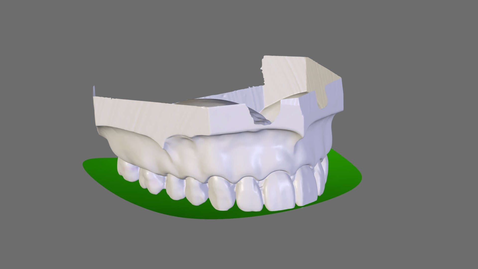 Modelo Superior Com Curva De Spee E Wilson - Download Free 3D model by ...