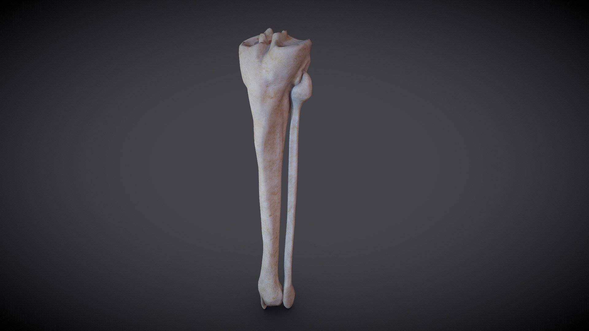 Tibia and fibula - Buy Royalty Free 3D model by Ebers [549732b ...