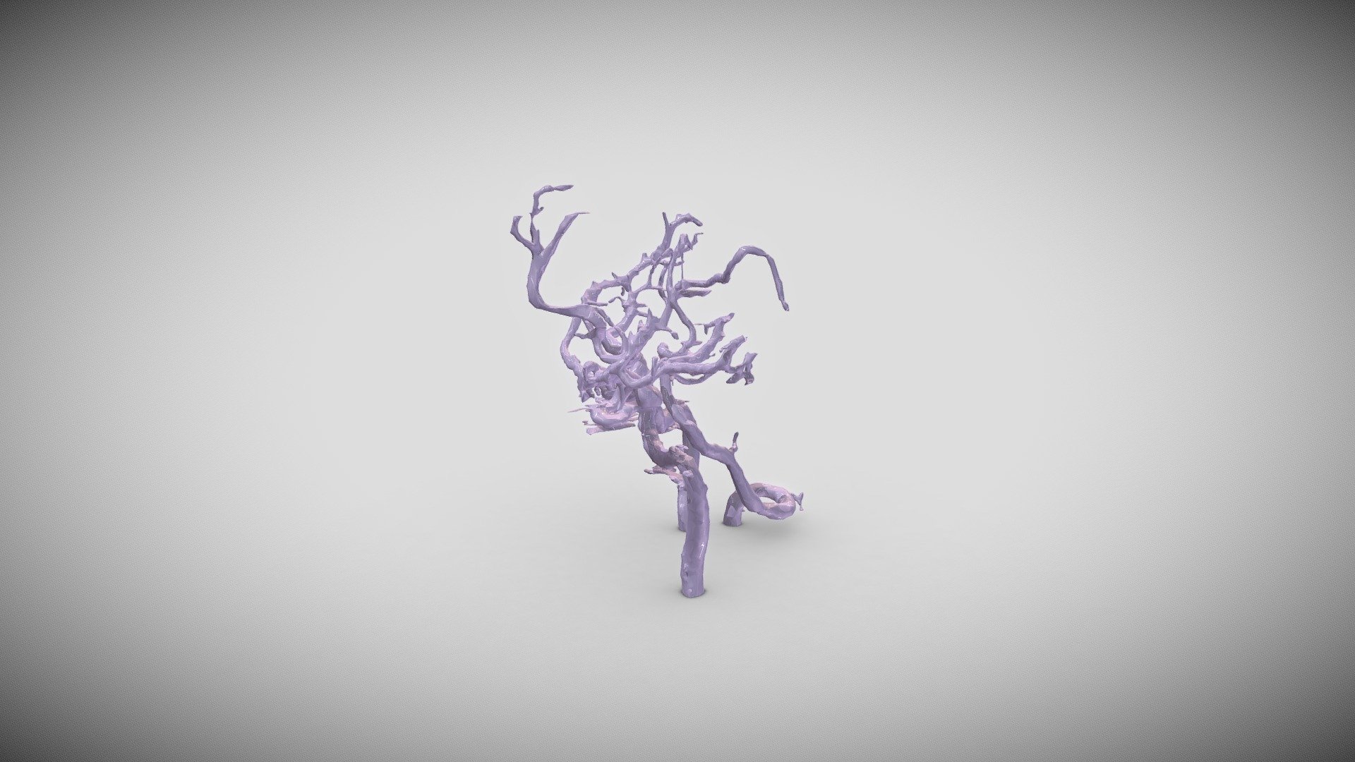 Left Pcom Aneurysm 3d Model By Dr Samuel Damin Sdamin [54d788b