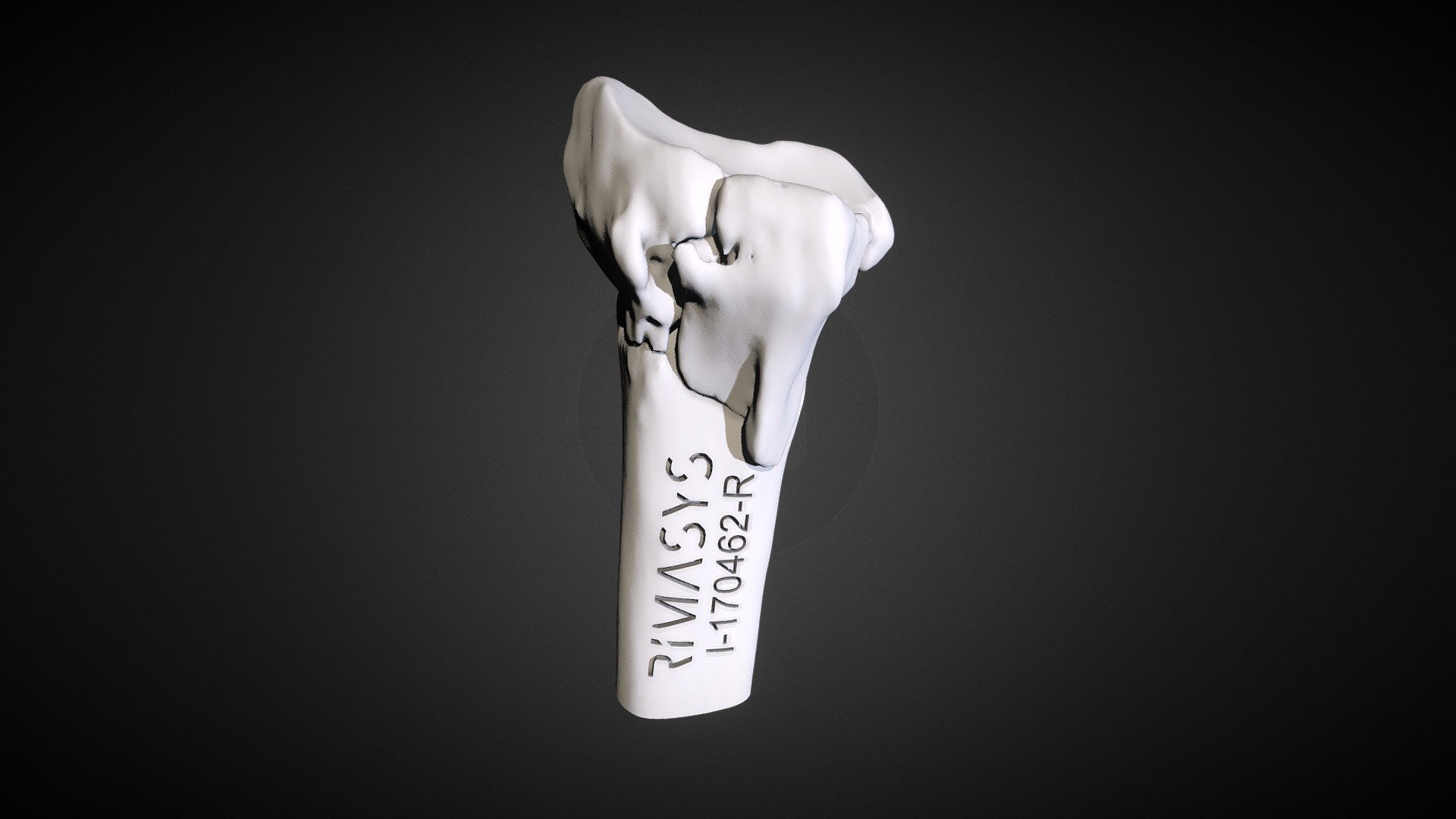 DKOU18 | distal Radius fracture | I-170462-R - 3D model by World ...
