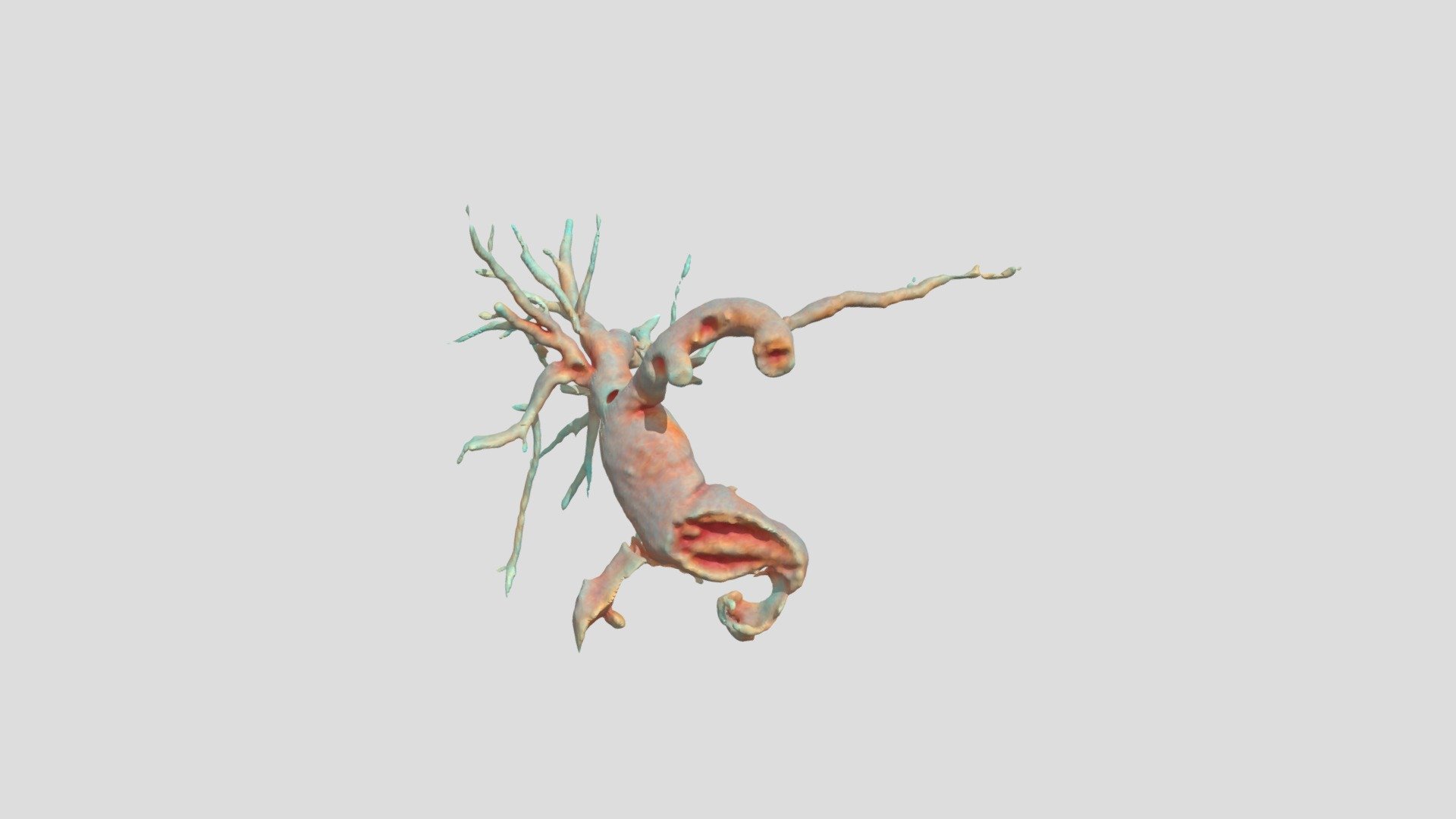 ROI Dicom - 3D model by CBI View (@cangelis5) [559b41a] - Sketchfab
