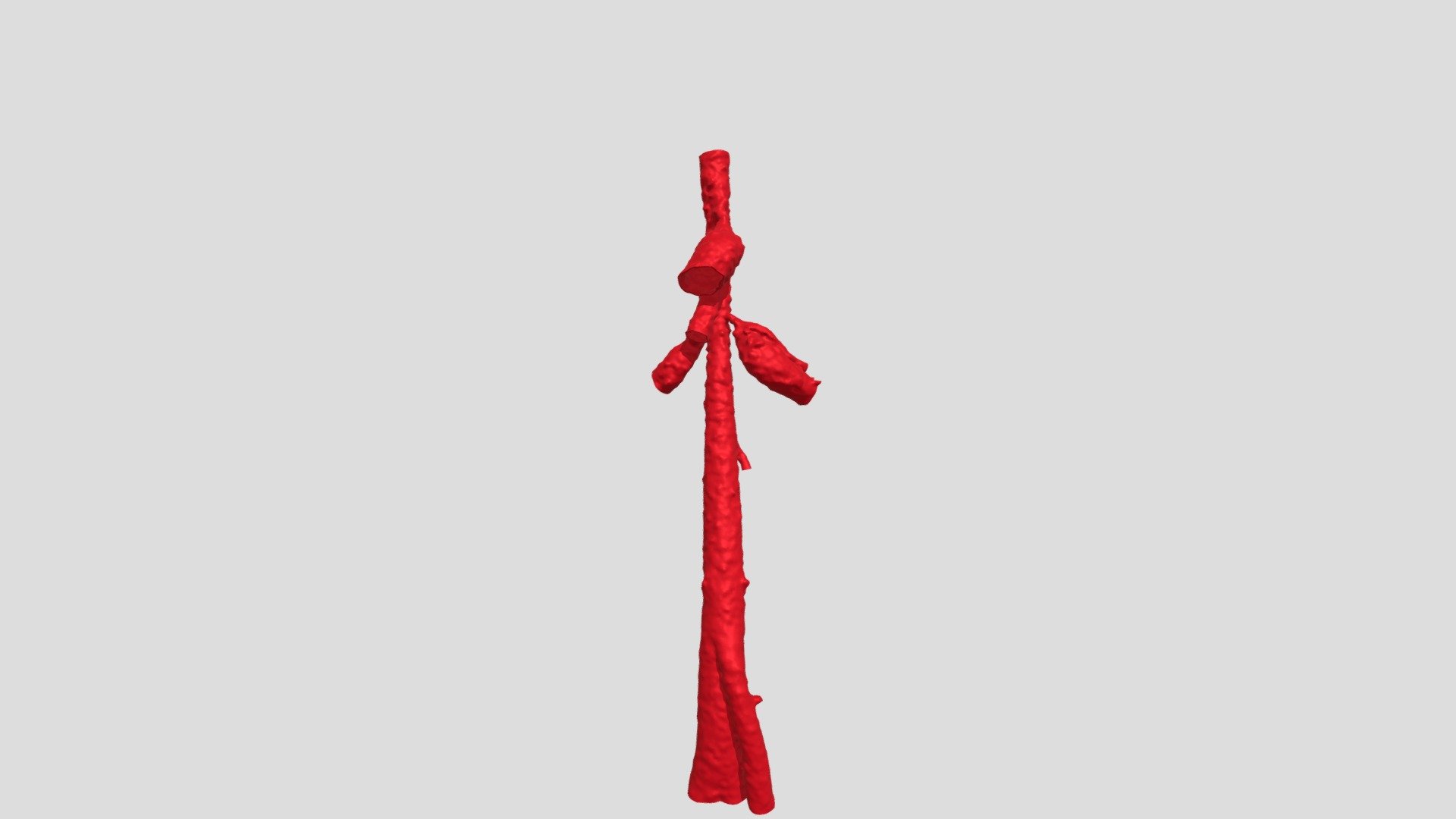 Abdomen aorta - 3D model by kobelev13 [55b4c95] - Sketchfab