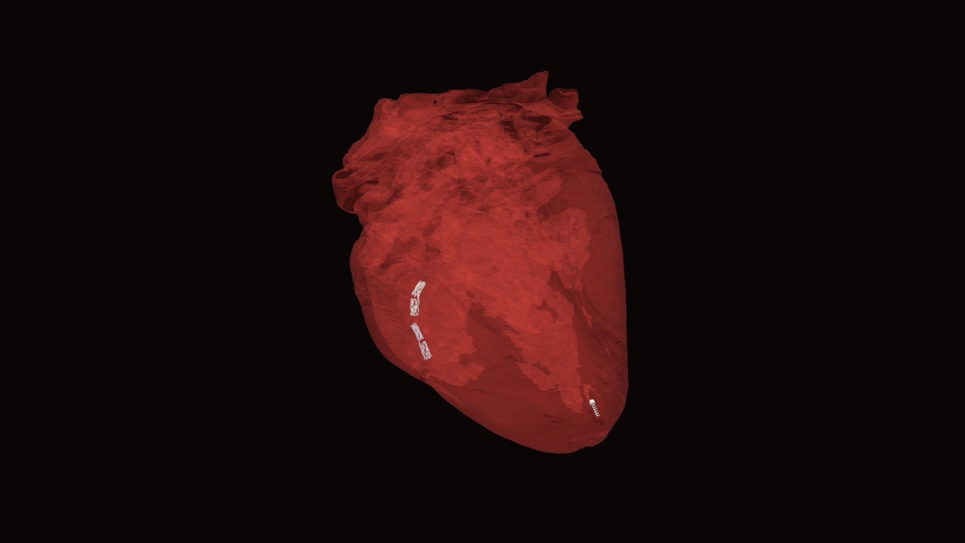 Heart0034 Male Heart with Pacemaker and Stents - Download Free 3D model ...
