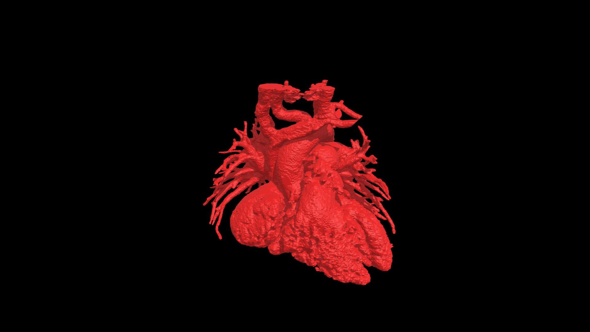 Double Ventricular Septal Defect Heart Model - 3D model by ...
