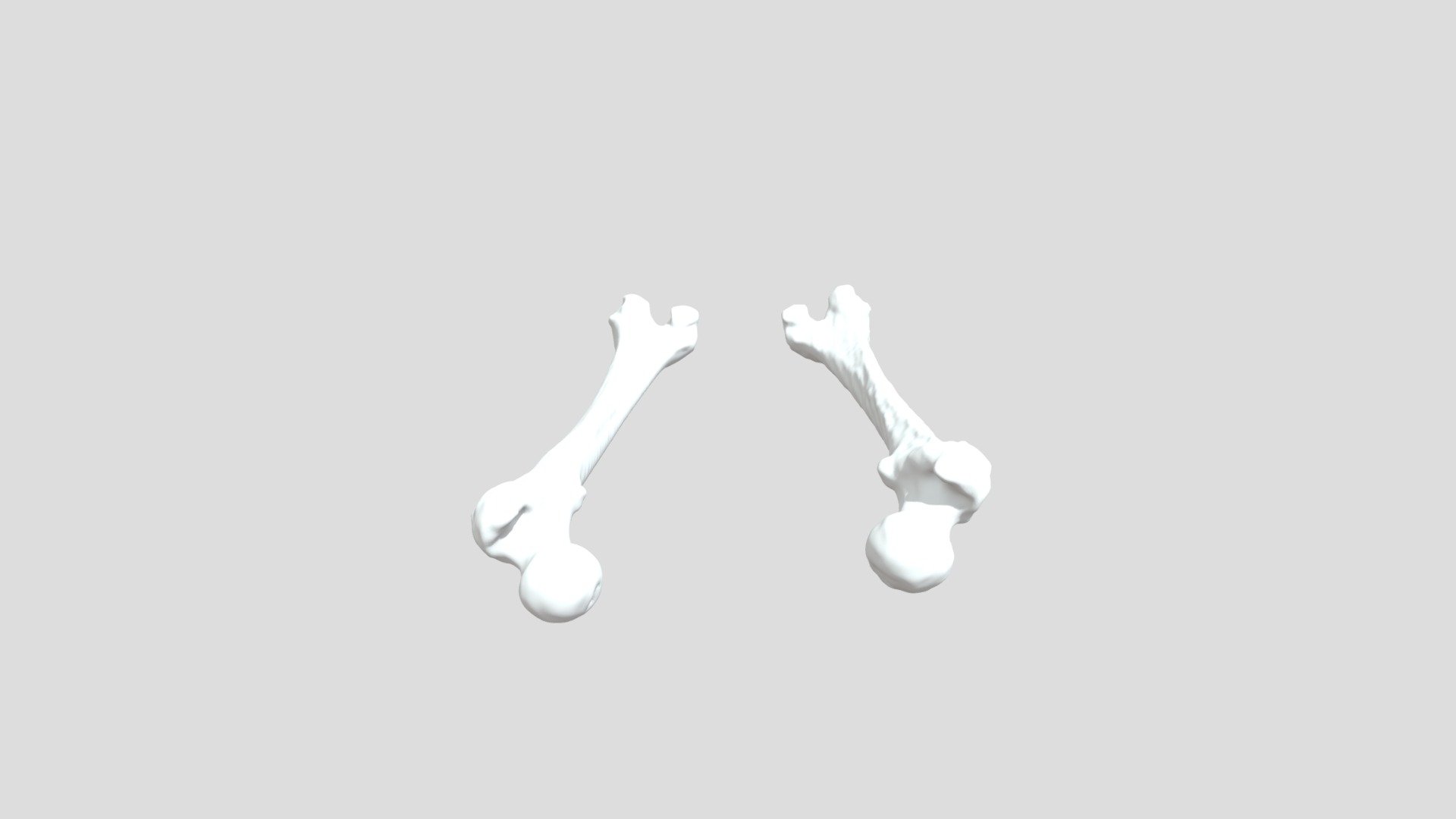 Femur-reg(1)_Remeshed_AllinOneUVmapped - 3D model by lisa.cuthbertson ...