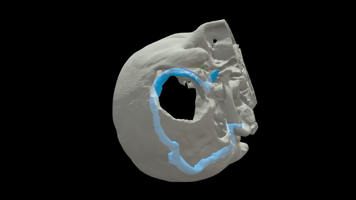 Posterior-fossa 3D models - Sketchfab