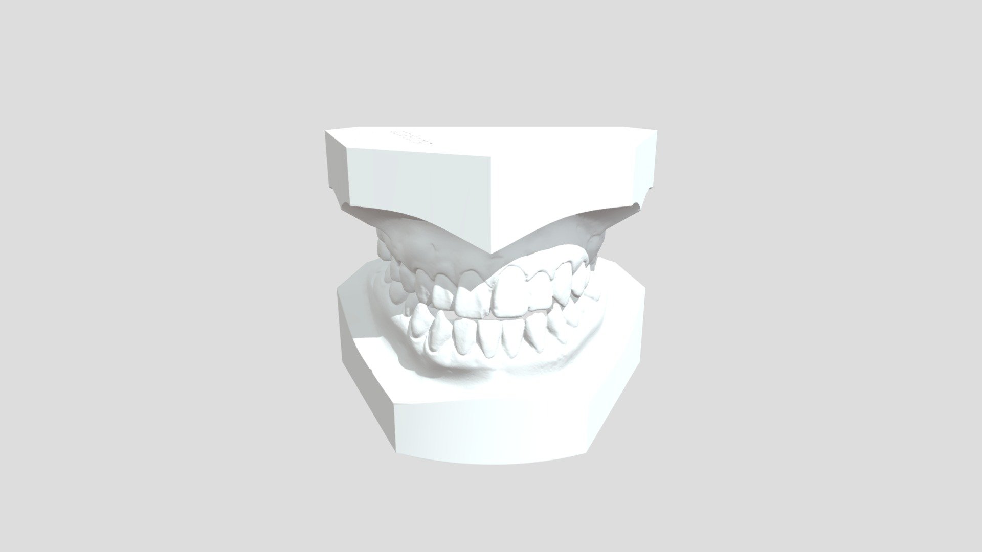 Case 3: Cl III A model JH Hwang - 3D model by orthogiant [56a679f ...