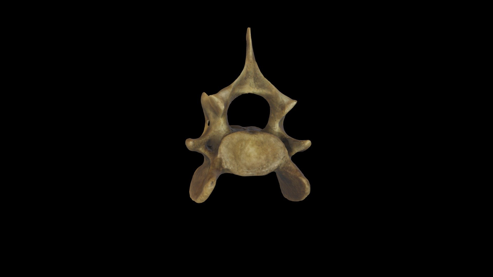 Pig- Cervical Vertibra - 3D model by University of Reading ...