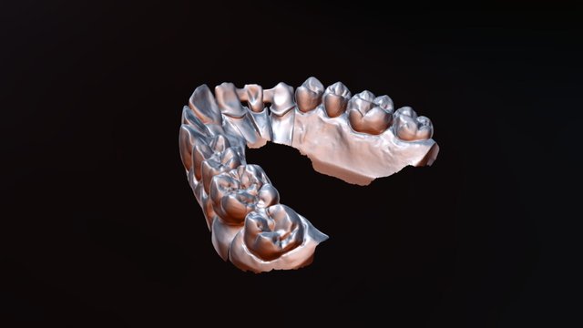 Exocad 3D models - Sketchfab