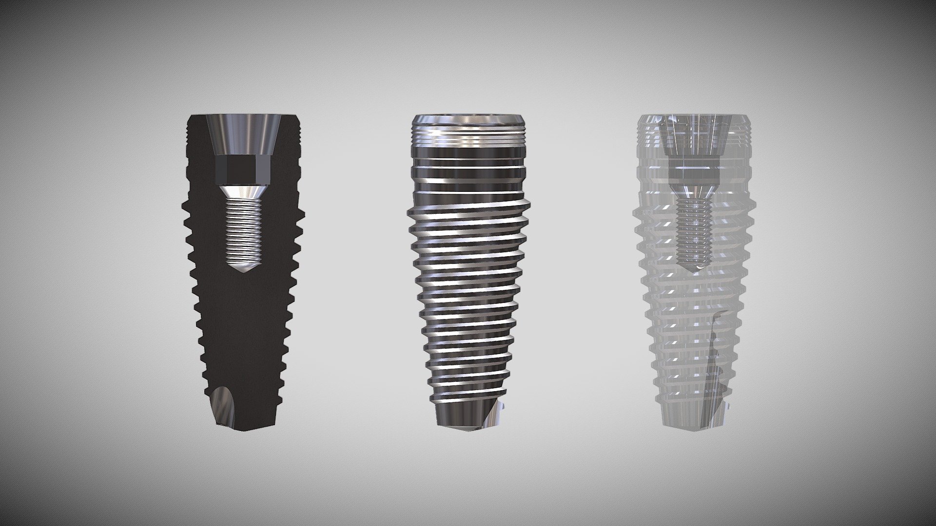 Dental Implant Macrogeometry - 3D model by Muhammad Nabeel ...