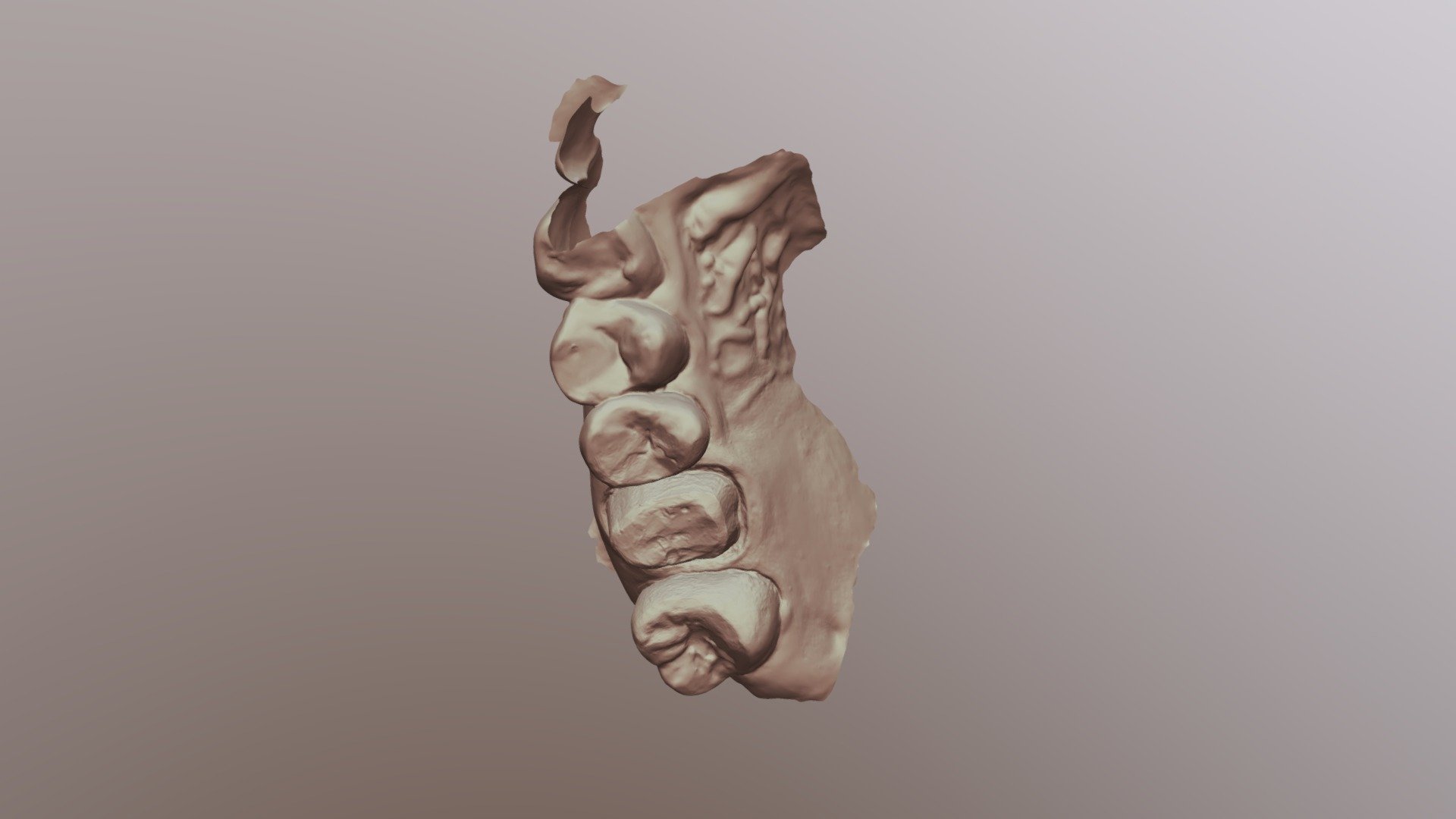 Upper Jaw Scan-4-2 - 3D model by latte0126 [57180c5] - Sketchfab