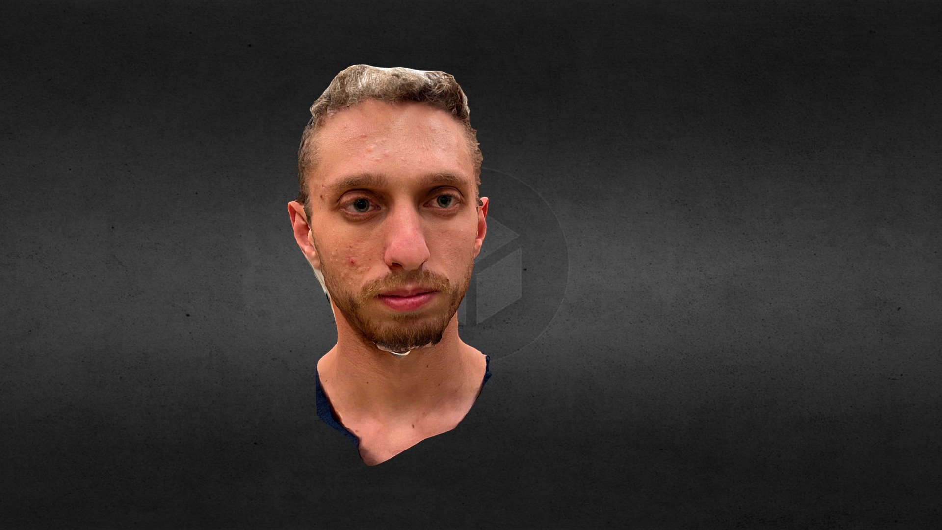 Face with active acne - 3D model by Cherry (@saar6266) [579c5e8 ...