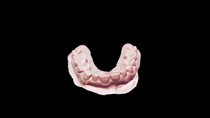 Denture 3D models - Sketchfab