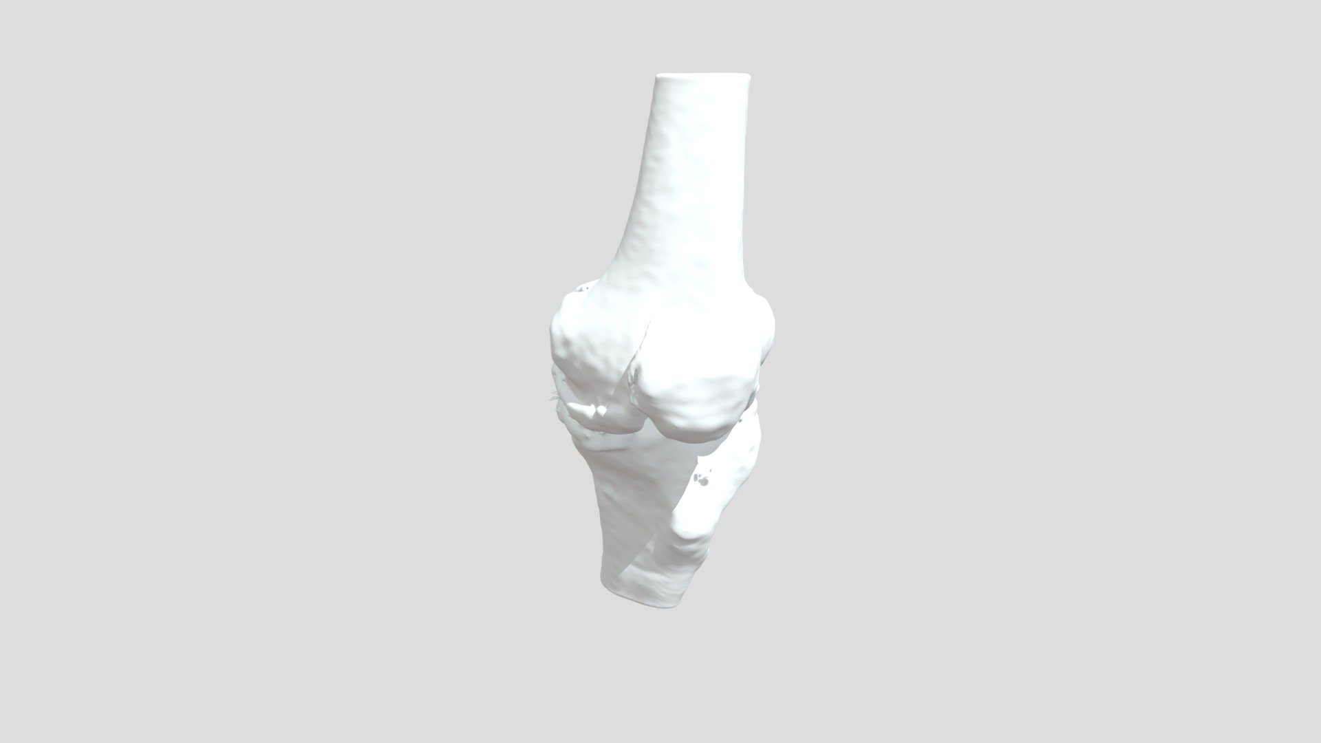 Segmentation Vim Lt Bone - 3D model by curisdata.science [582f524 ...