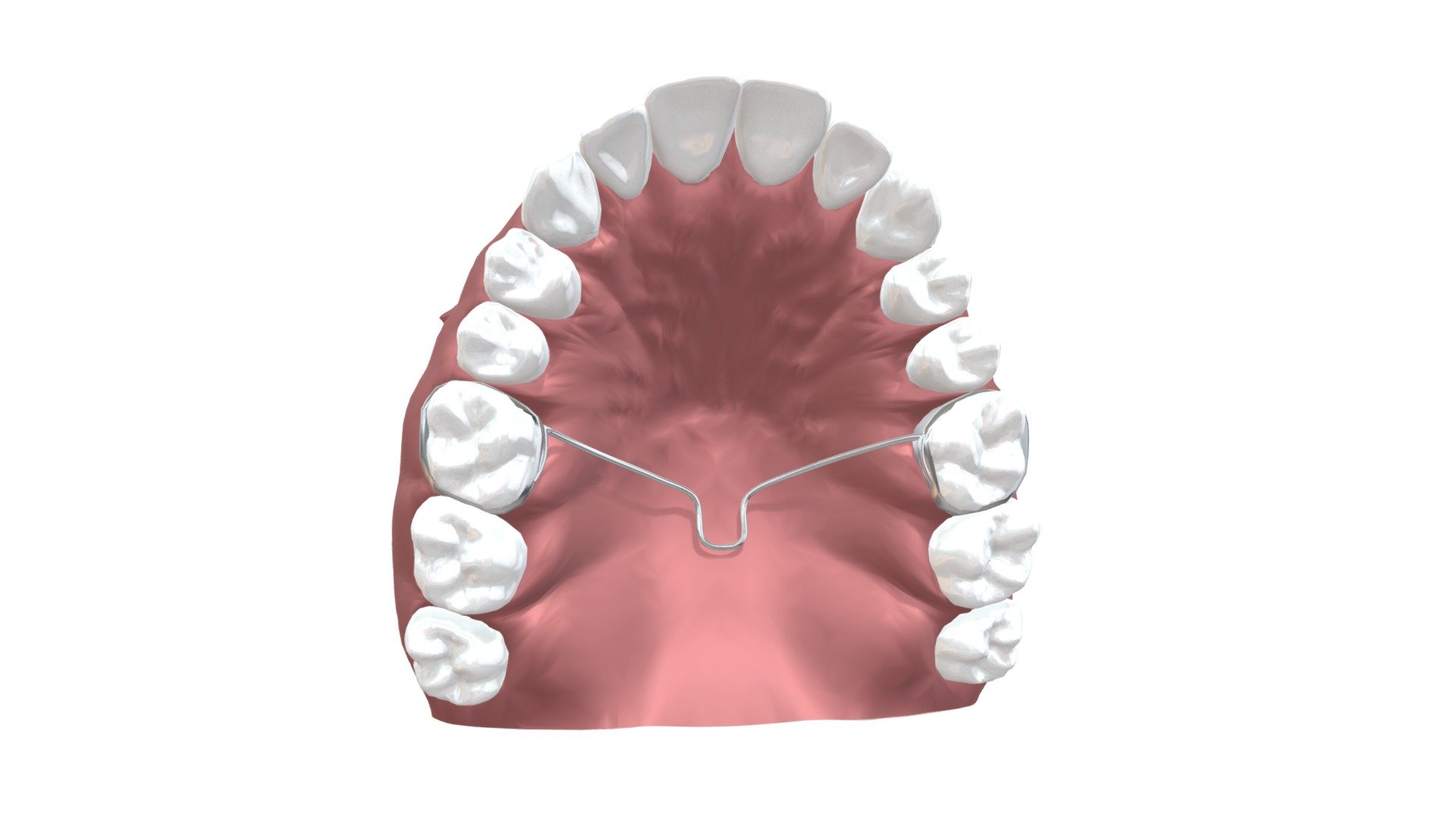 Transpalatal Arch - 3D model by Interactive 3D Data (@proteinsimulation ...