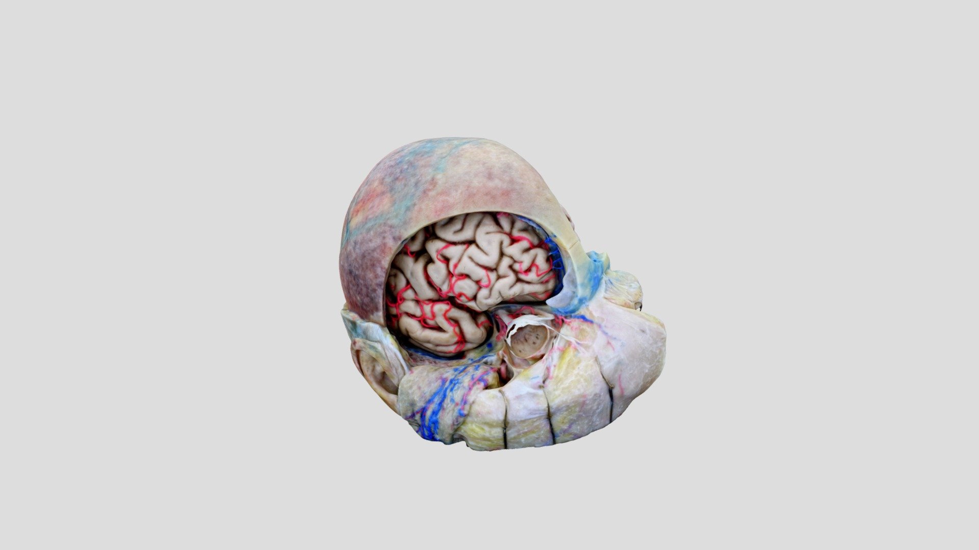 Bilateral Head dissection - 3D model by vv (@verav) [5848fd0] - Sketchfab