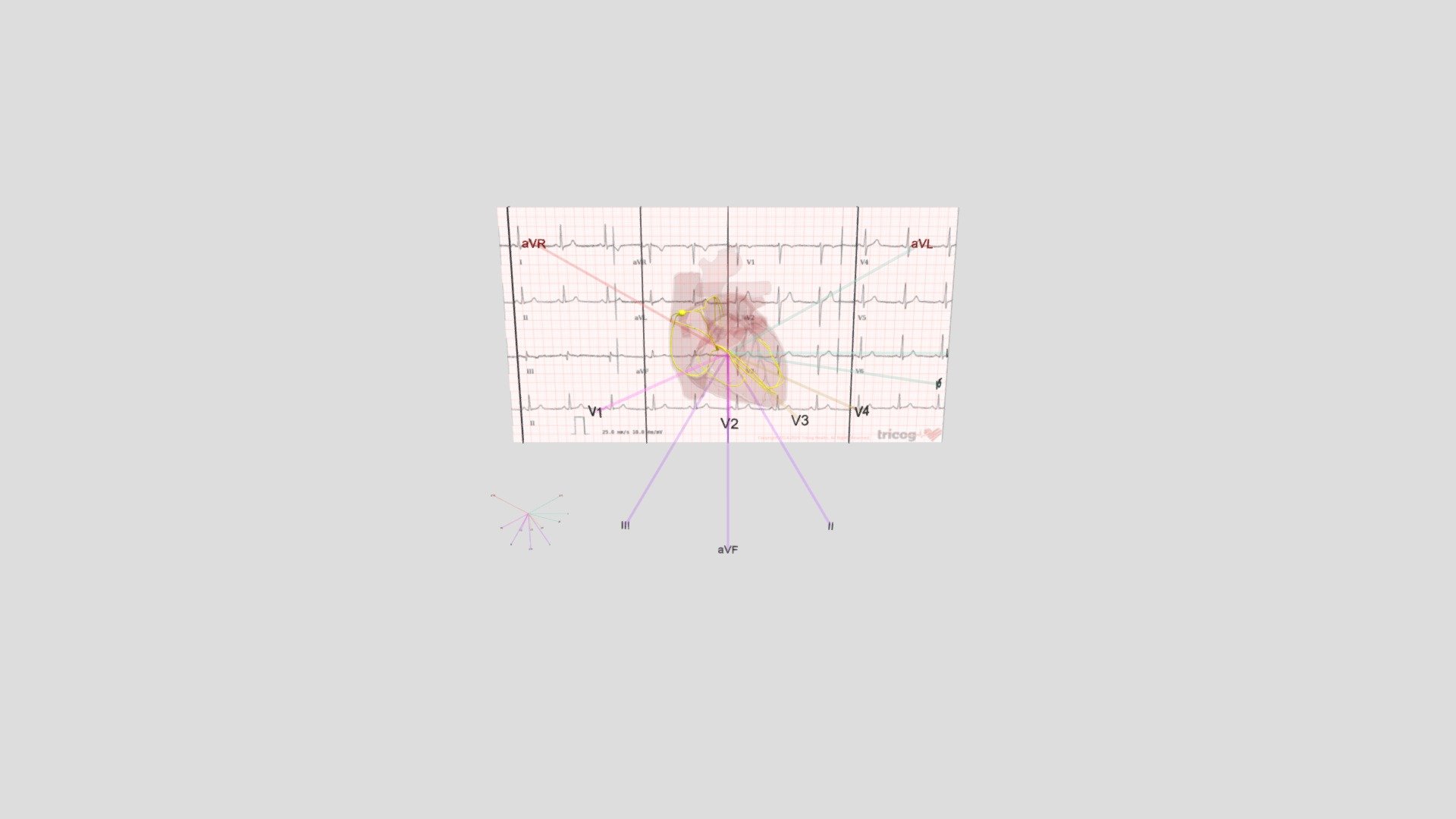 Heart conduction synced with vector & ECG - 3D model by ShlomiD ...