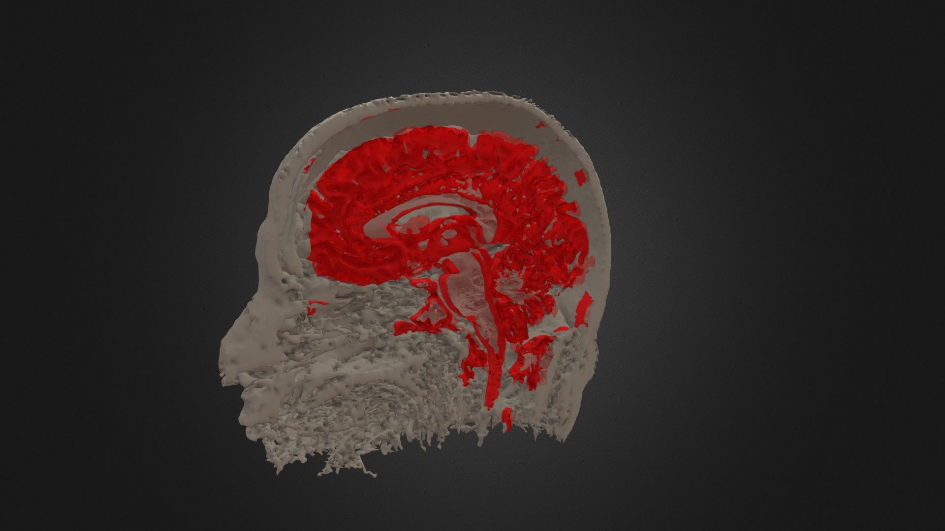 CT SCAN BRAIN - 3D model by Something [58e2a82] - Sketchfab