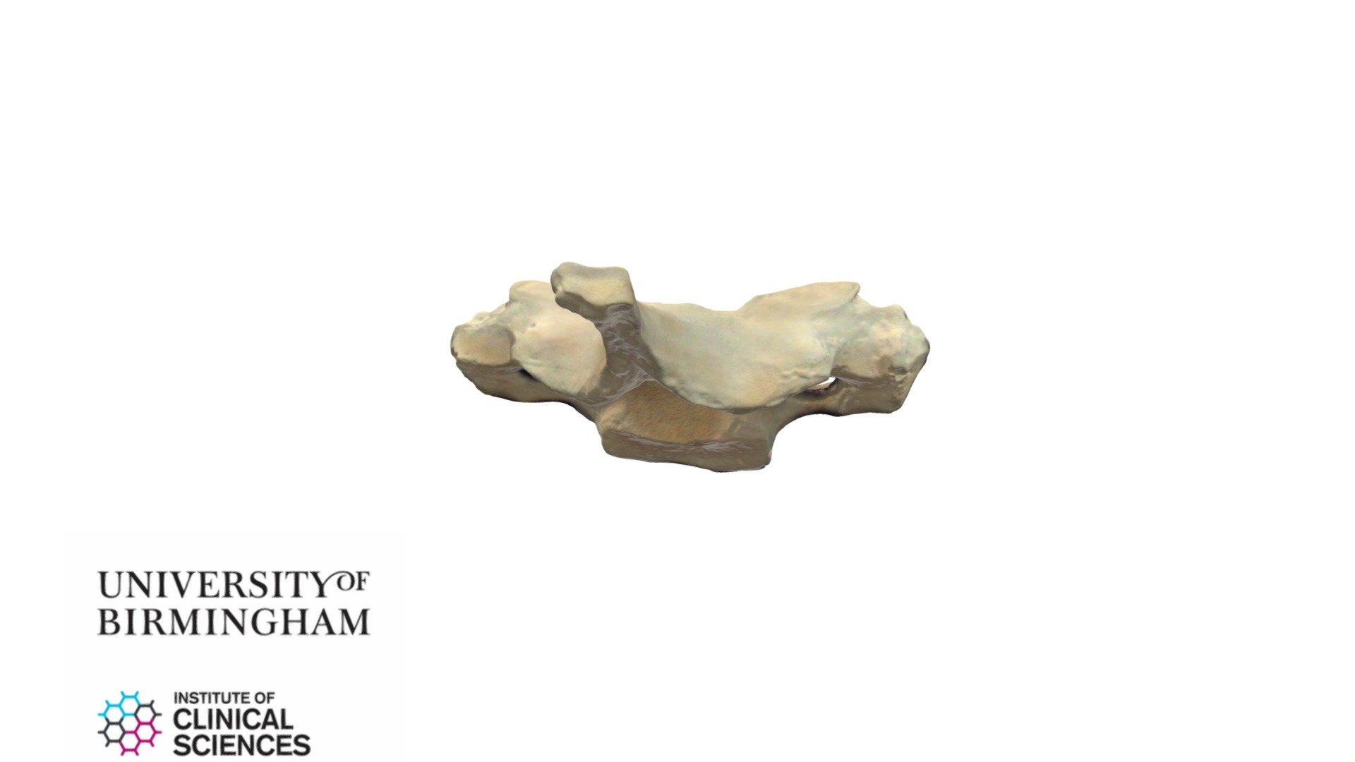 Vertebra Prominens - 3D model by UoB_Anatomy (@UoB_Anatomy) [5928e69 ...