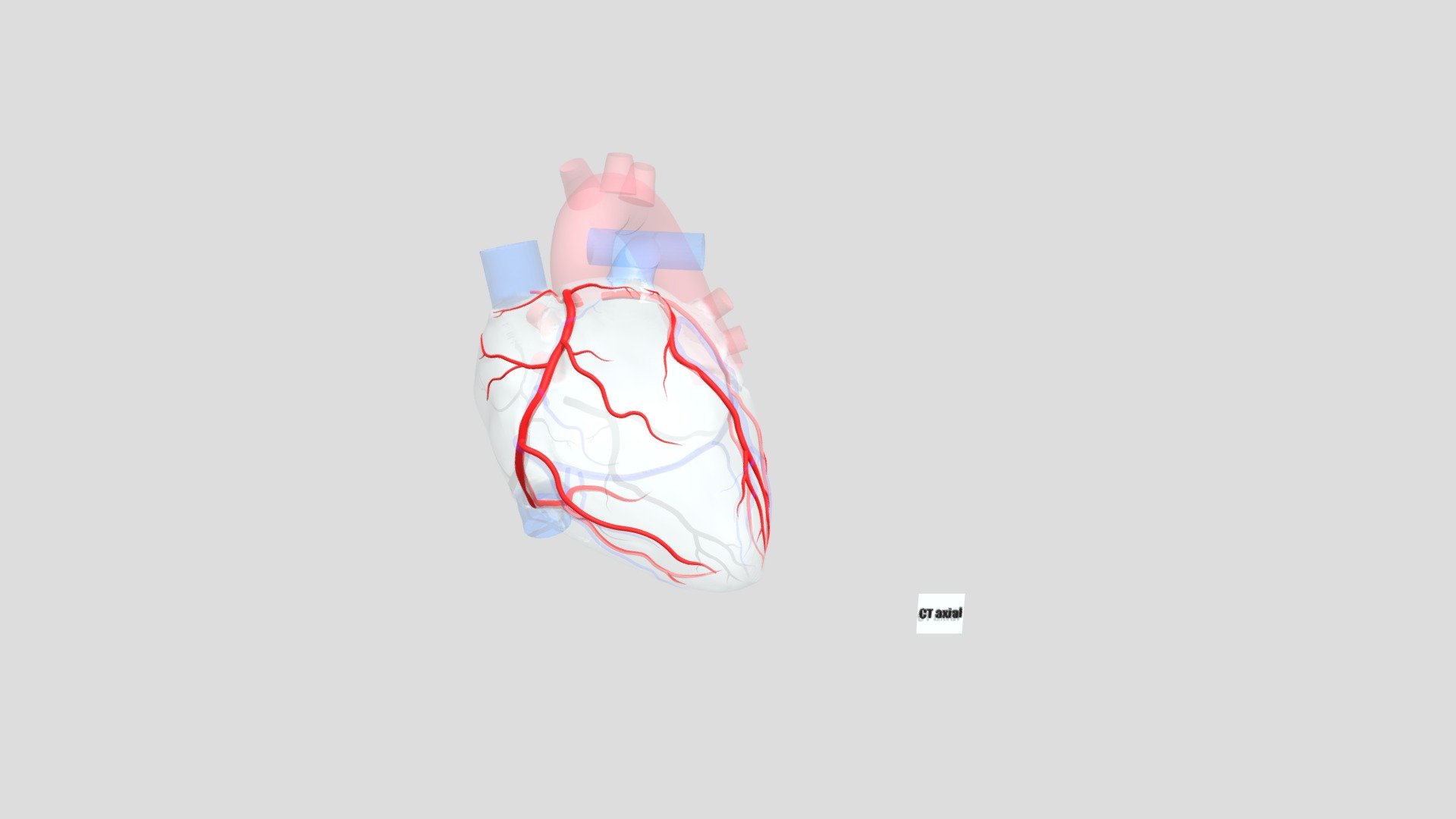 Coronary Artery System - 3D model by chayadaphechkrai [593d6f9] - Sketchfab