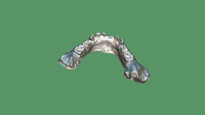 3shape 3D models - Sketchfab