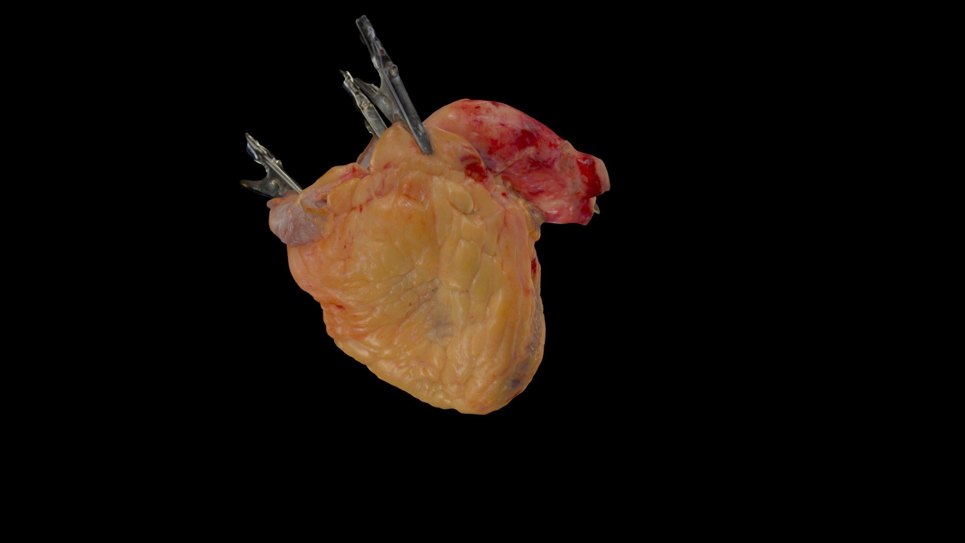 Fresh Human Heart Organ Donation - Download Free 3D model by ...
