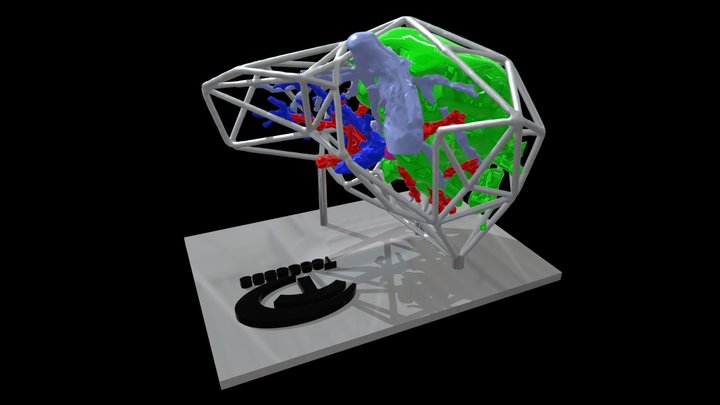 Dicom2stl 3D models - Sketchfab