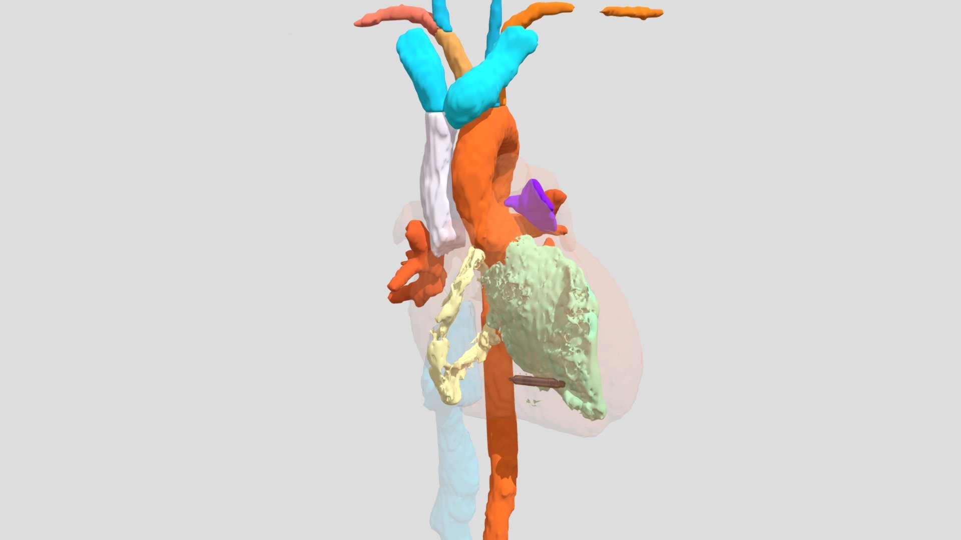 Leadless Pacemaker 3D Model - 3D model by dustynash [5a2aeb3] - Sketchfab