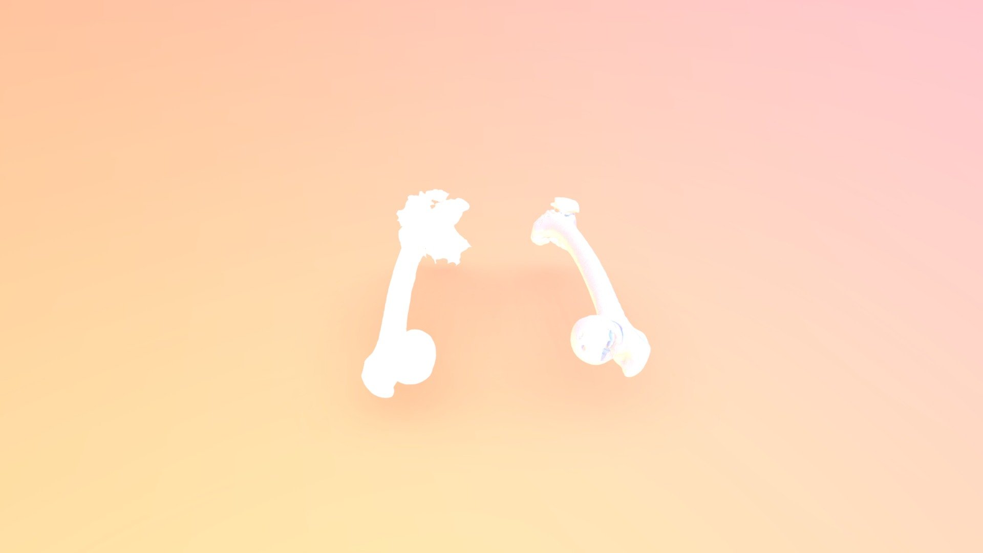 Femur Segmentation Download Free 3d Model By Grofovad [5a6abed] Sketchfab