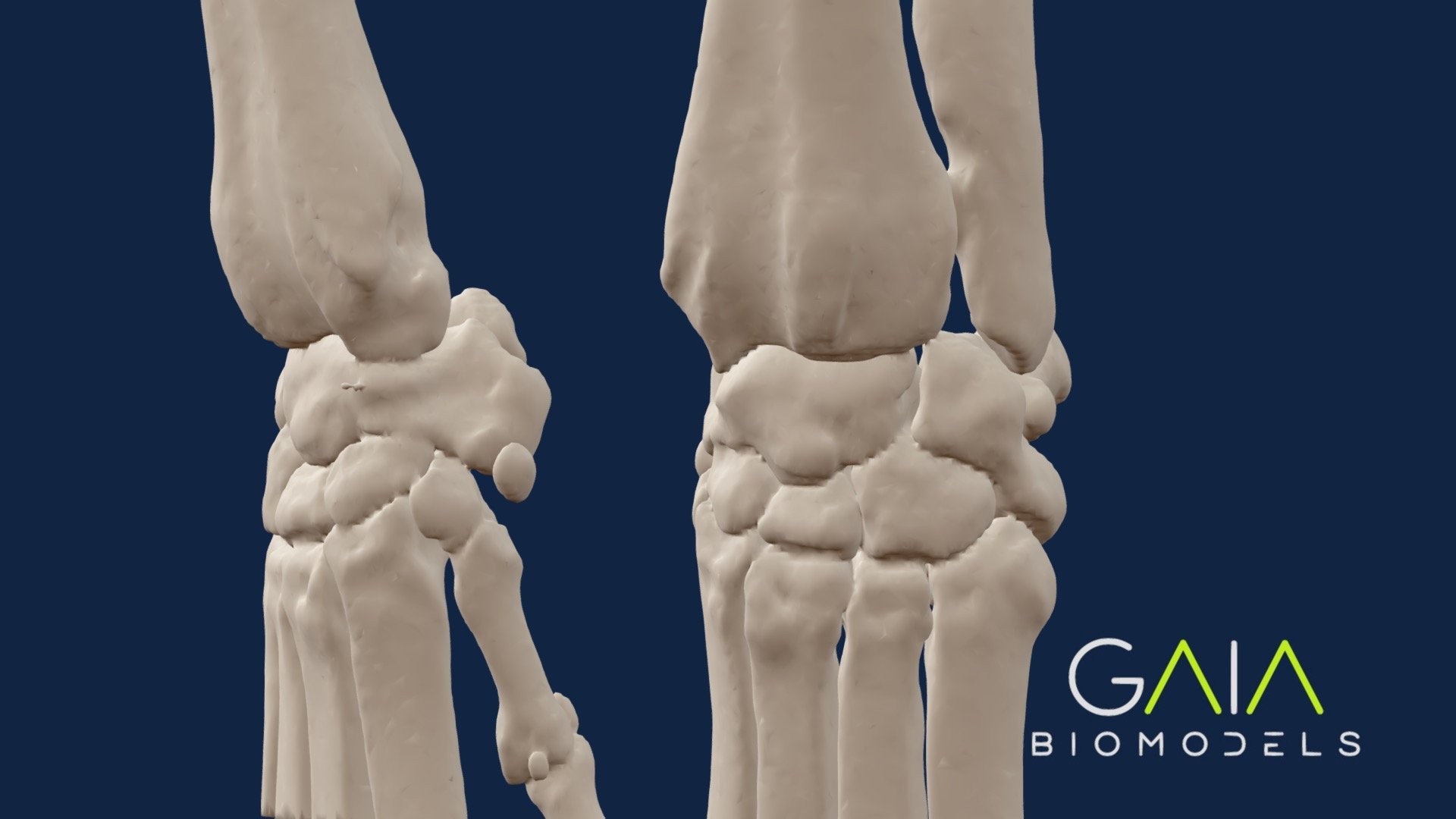 Accessory carpal bone fracture - DOG - 3D model by GAIA Biomodels ...